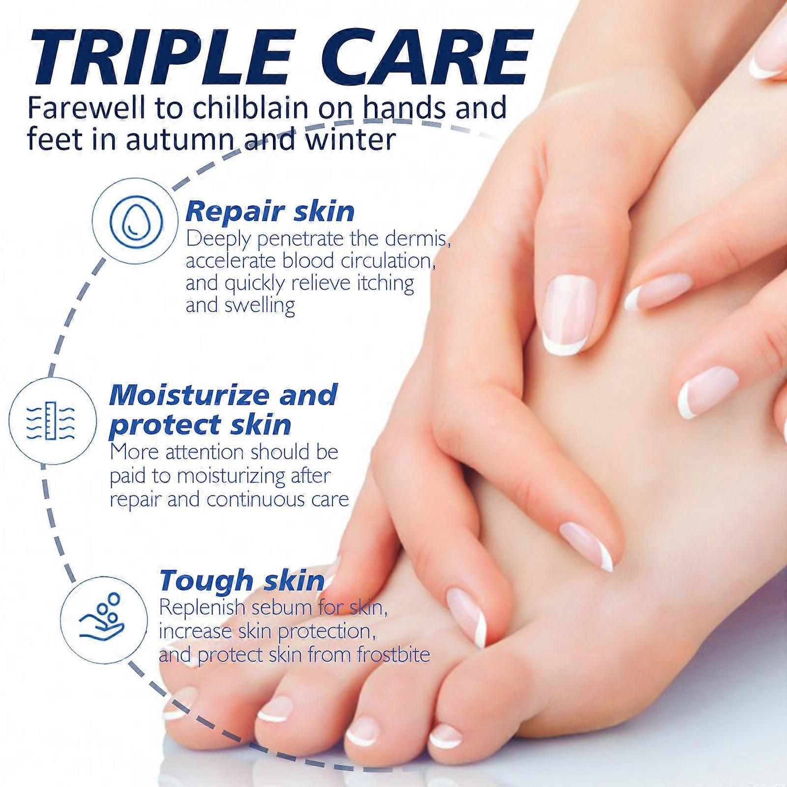 30ML Chilblain Cream Anti-cracking Frostbite Moisturiser Deep ...