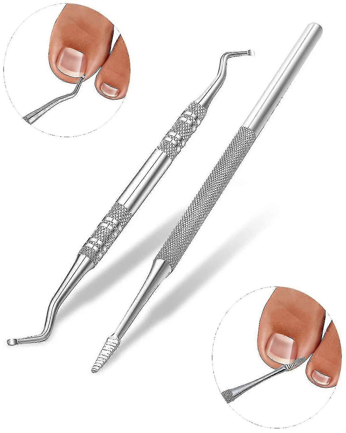 (50+2) Pack Professional Ingrown Toenail Correction Treatment Kit, 50 ...