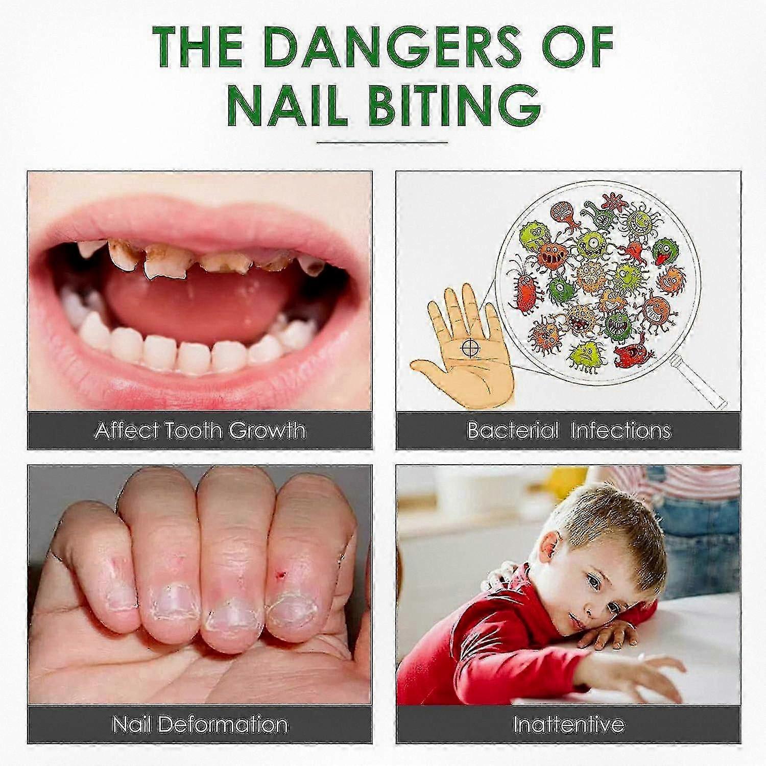 Anti-Bite Nail Polish for Kids, 10ml Bitter Taste Treatment to Stop ...