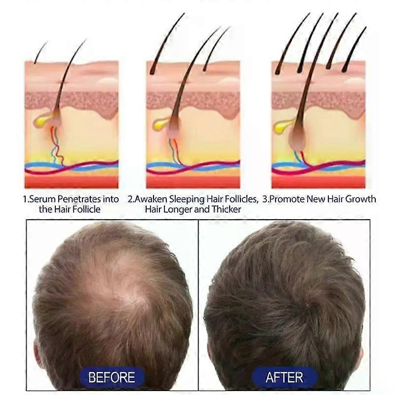 Toppik Hair Loss Building Fibers Hair Fibers Regrowth Powders Keratin ...