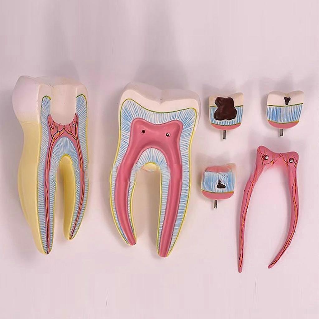 Human Tooth Model Molar Tooth Anatomy Model, Dental Teeth Model for ...