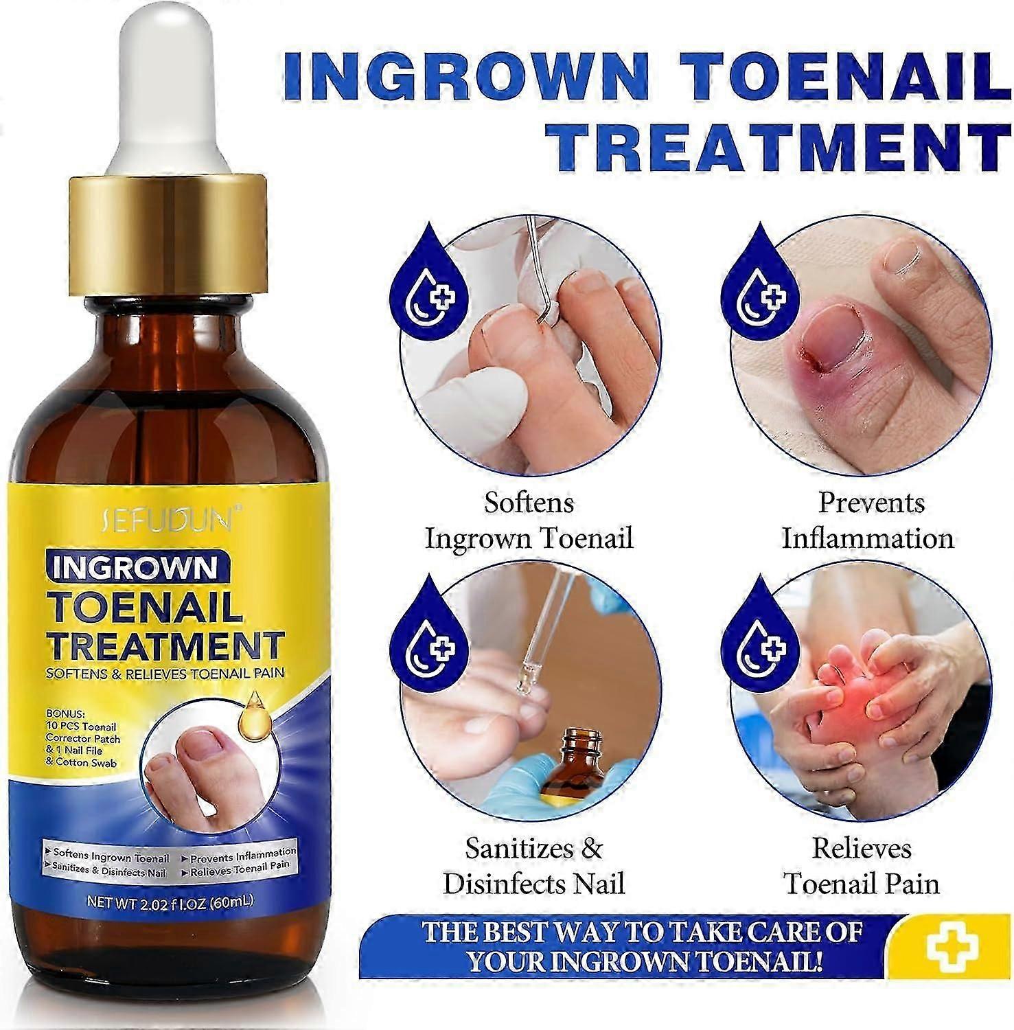 Ingrown Toenail Treatment 60ml, Softener Ingrown Toenail for Easy ...