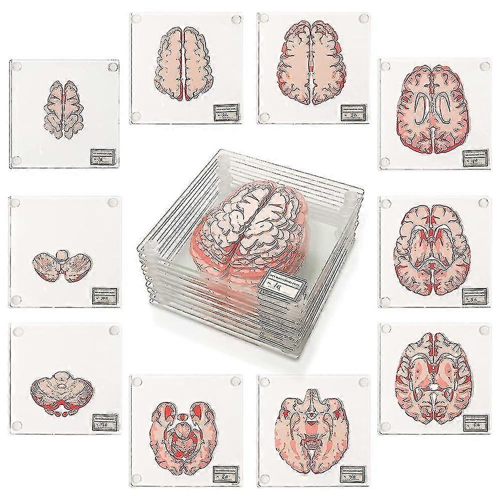 Anatomic Brain Specimen Coasters-gifts For Medical Student Gifts Brain ...