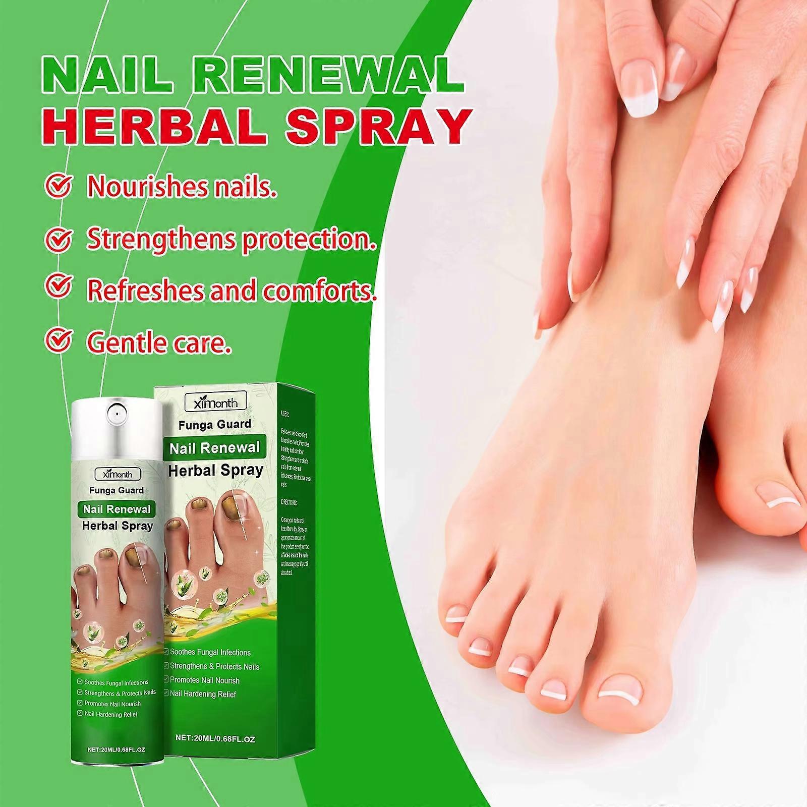 Fungal Nail Repair Spray Anti Infection Paronychia Solution ...