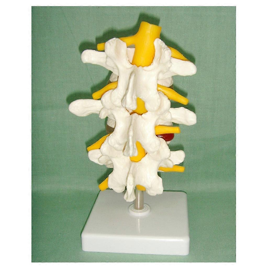 Human Cervical Vertebra Carotid Artery Flexible Spine Model Human ...