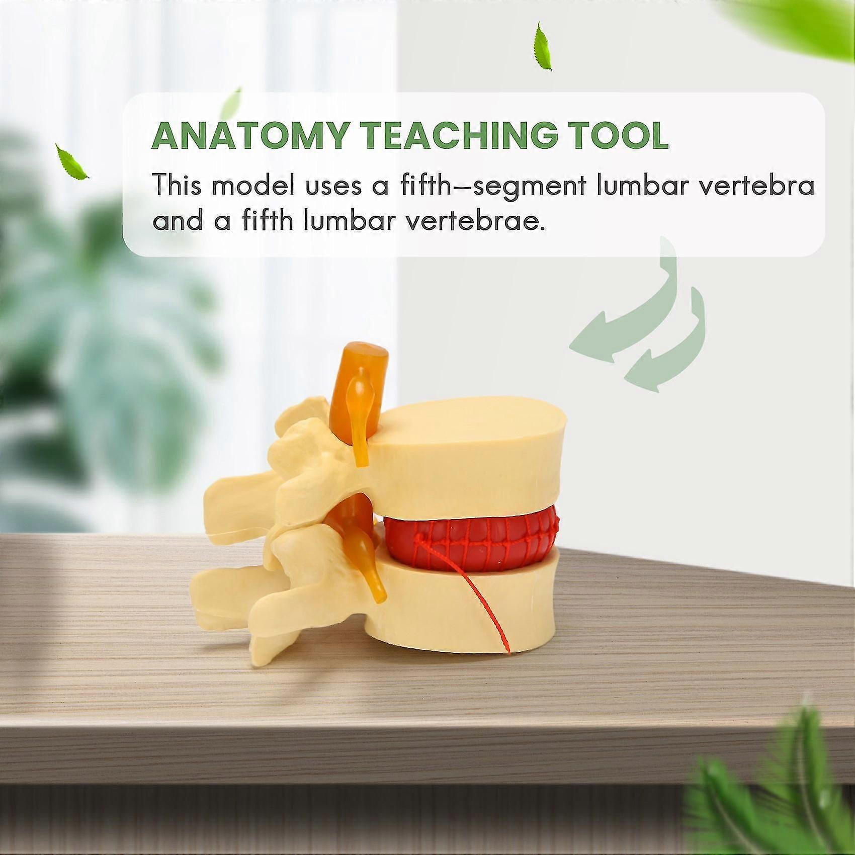Lumbar Vertebrae Model Anatomical Spine Lumbar Disc Herniation Anatomy ...