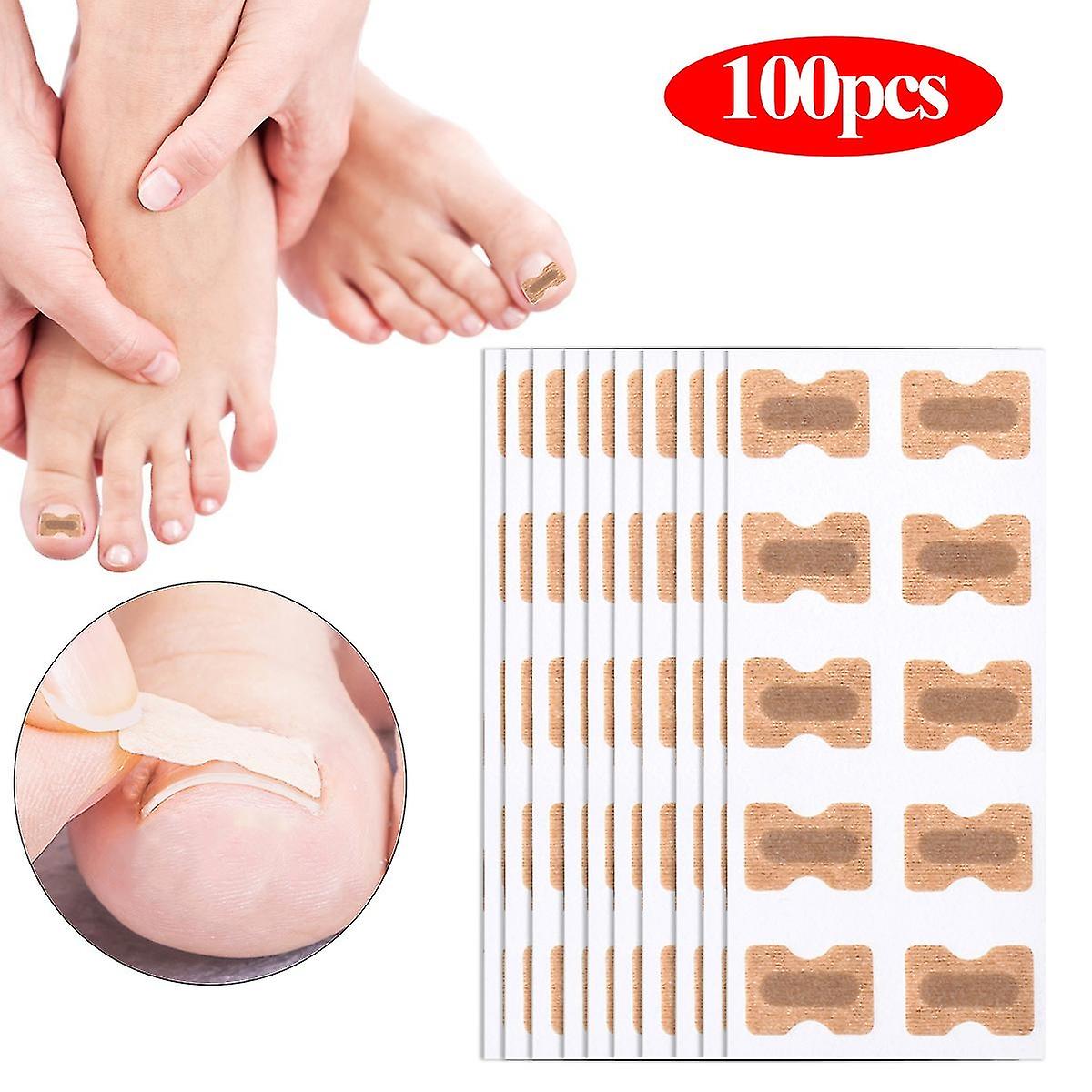Nail Correction Stickers Ingrown Toenail Corrector Patches | Fruugo UK