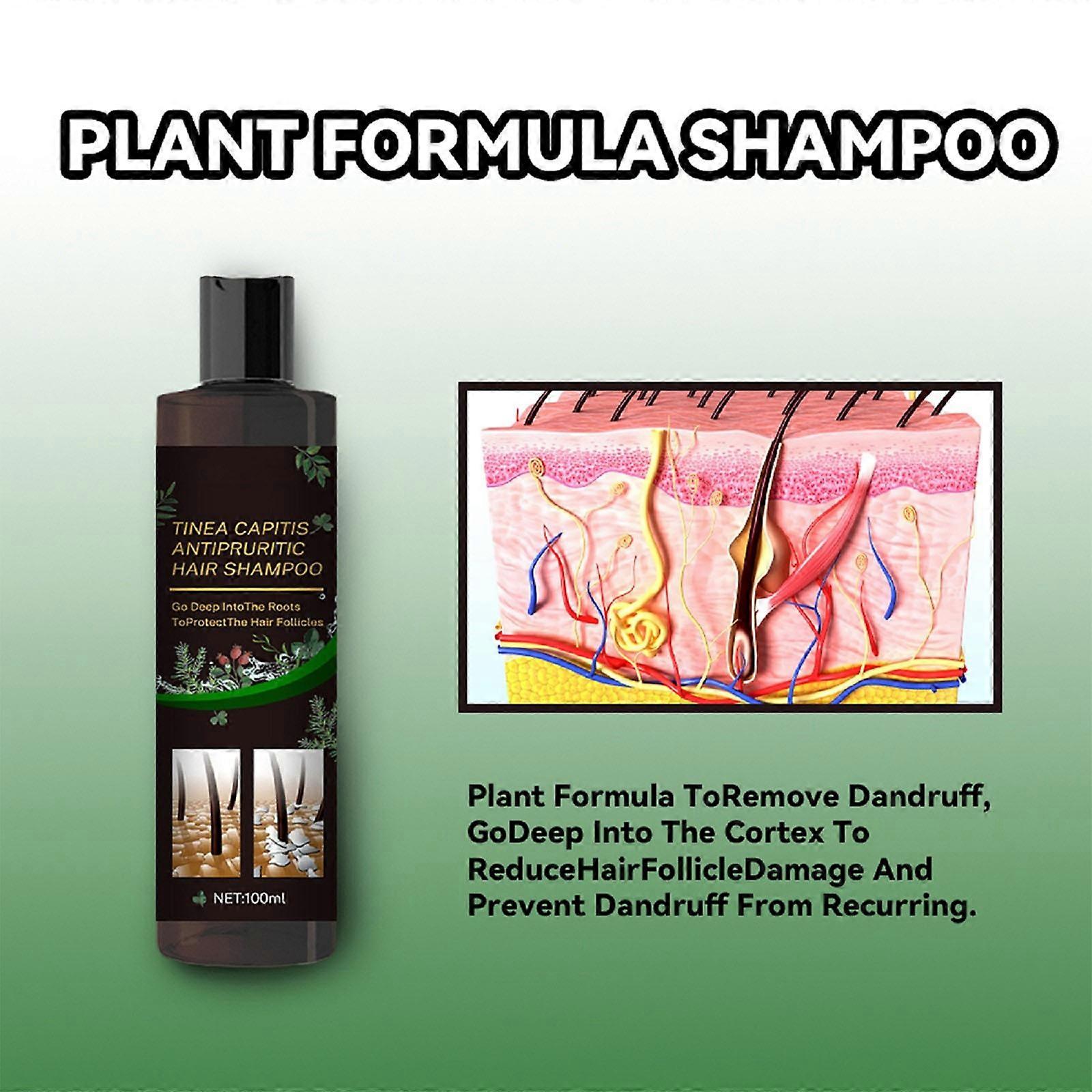 Anti-itch Shampoo For Tinea Capitis To Dandruff And Relieve Itchy Scalp ...