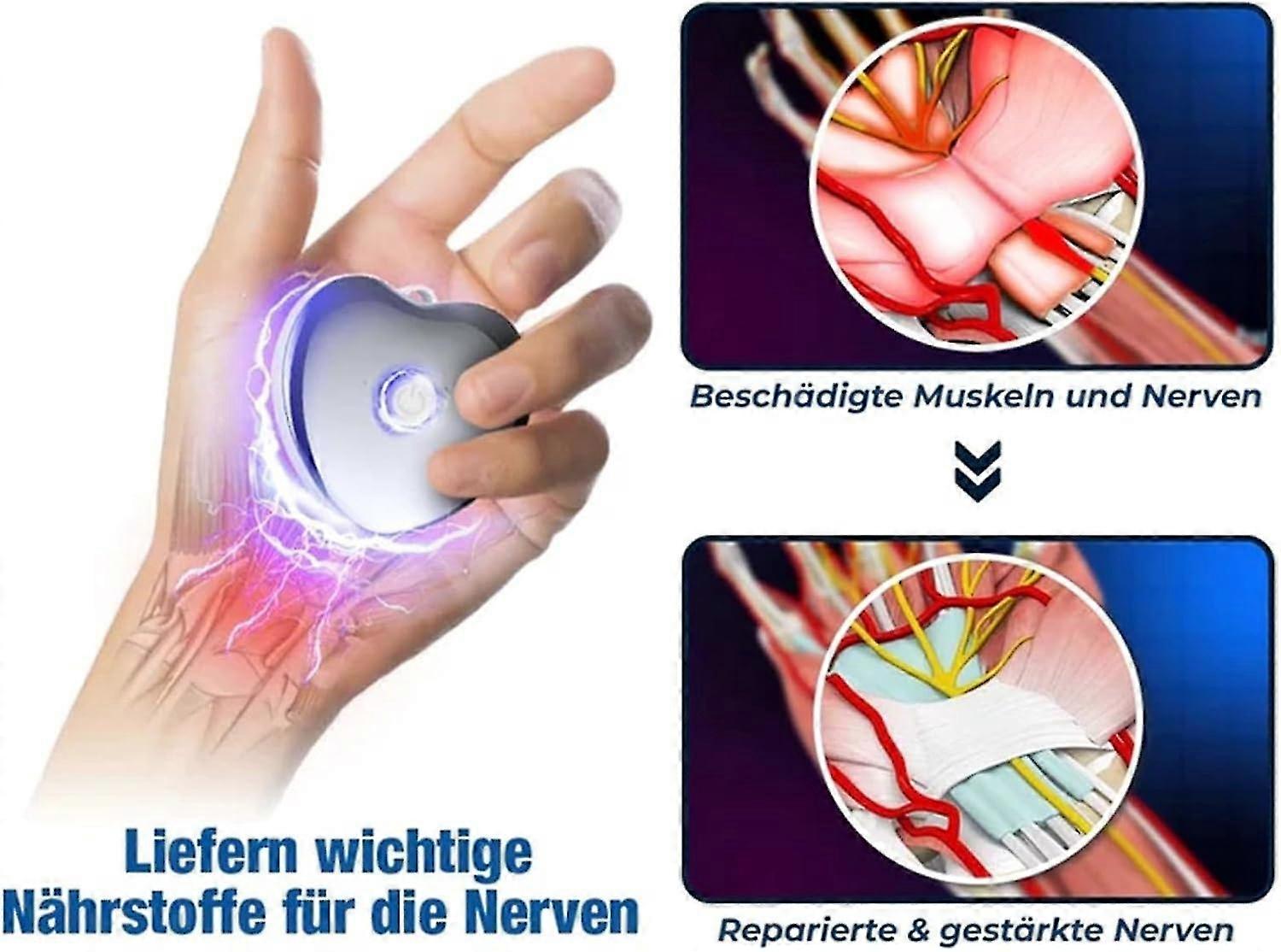 Nerve Ease Carpal Tunnel Treatment Device, NerveEase Carpal Tunnel ...