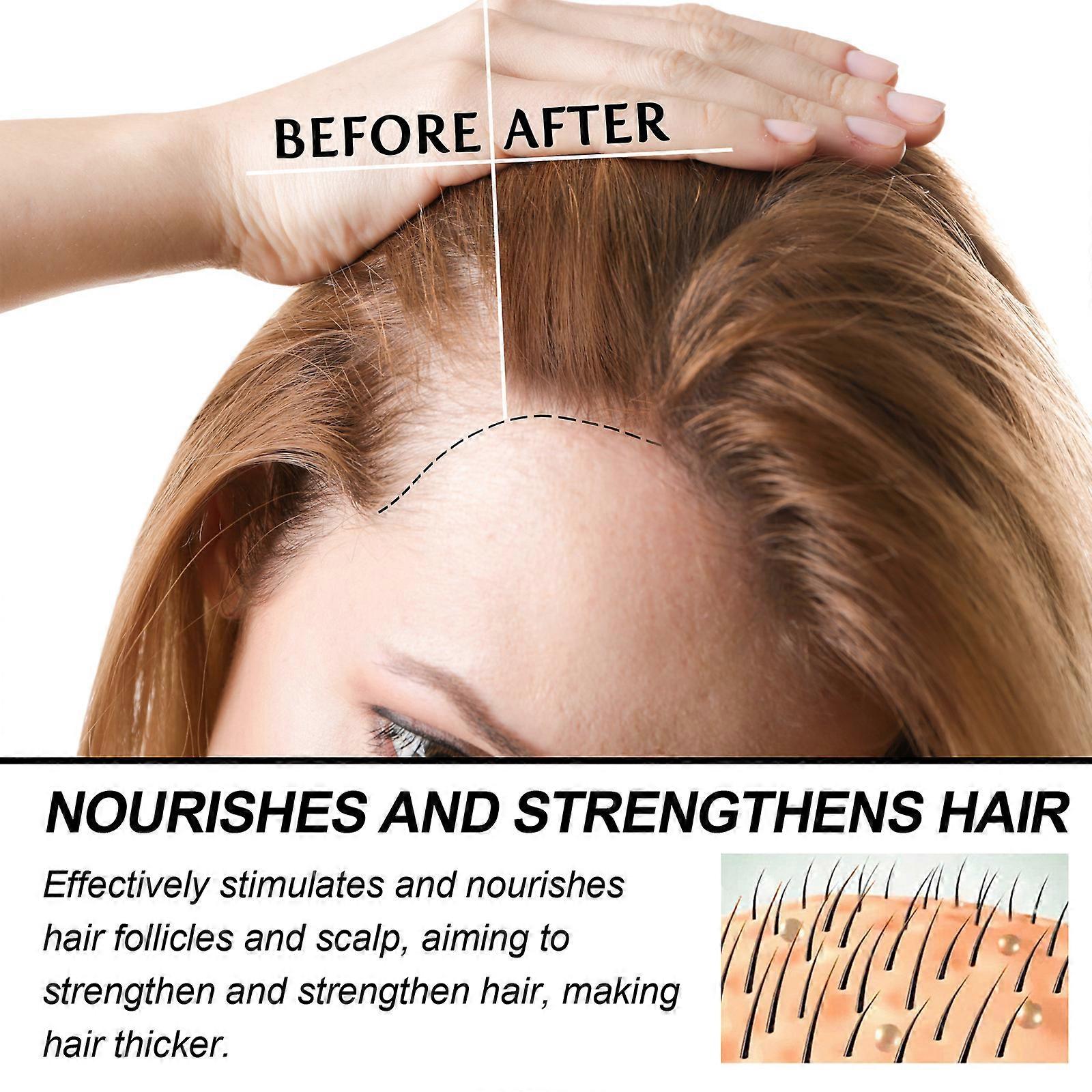 Hair Growth Serum, Natural Hair Regrowth & Thickening Treatment Serum ...