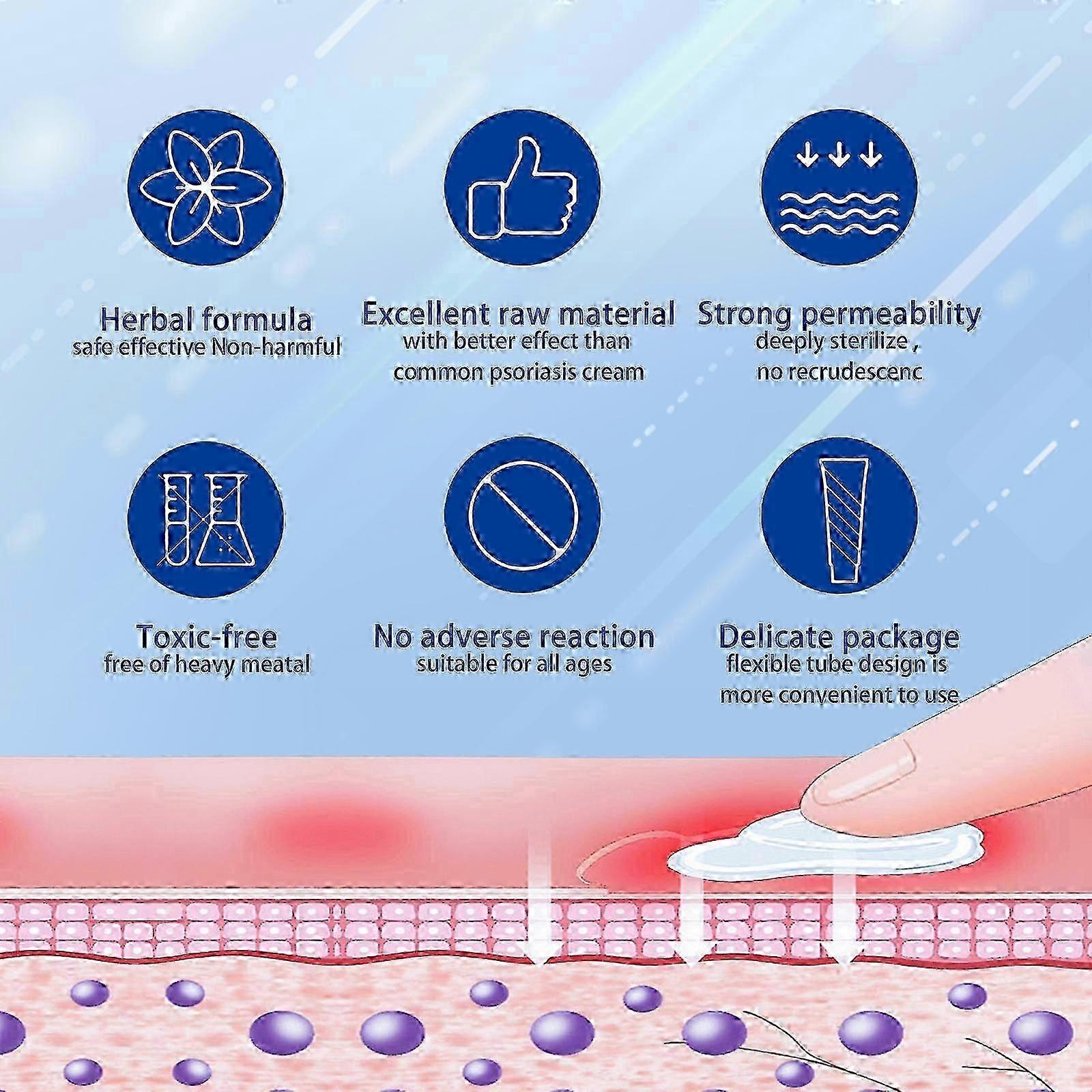 South Moon Anti-itch Cream for Dry and Itchy Skin, Rash, and Prickly ...