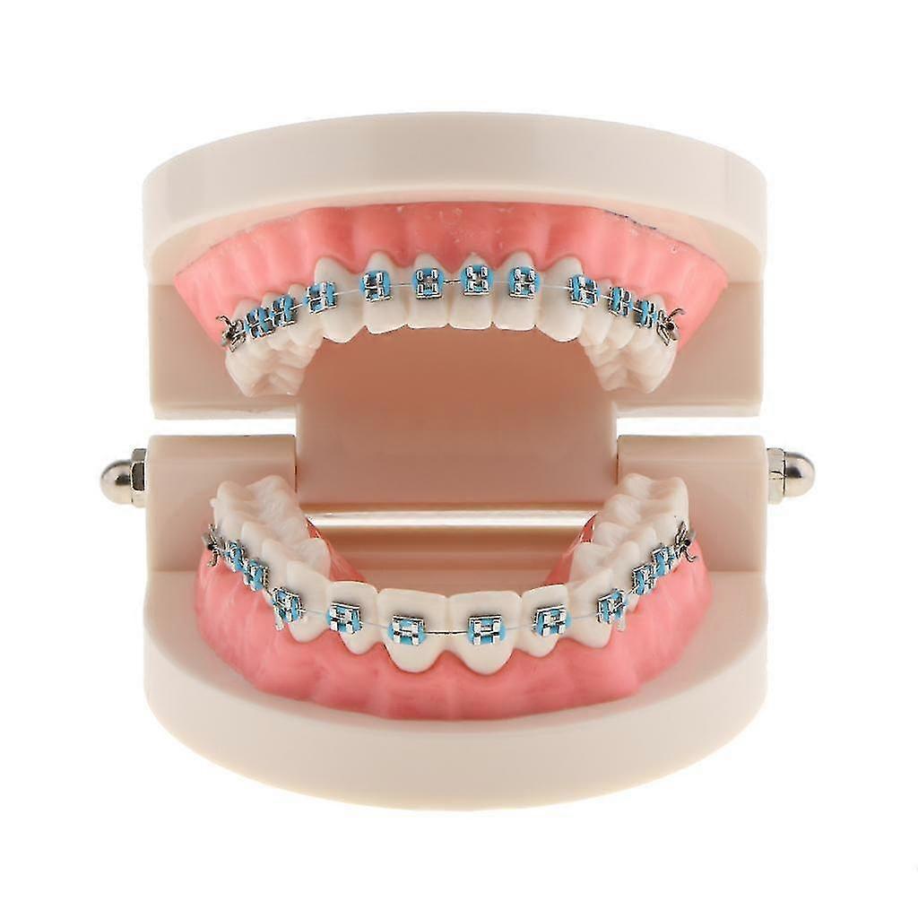 Dental Teach Study Orthodontic Tooth Teeth Model With Metal Brackets ...