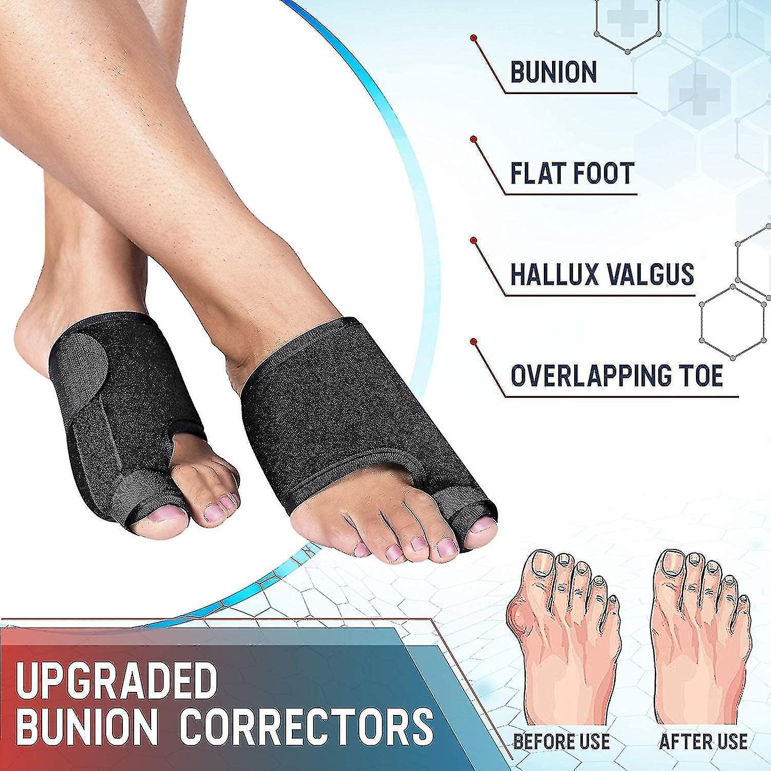 Bunion Corrector And Bunion Relief, Orthopedic Big Toe Straightener ...