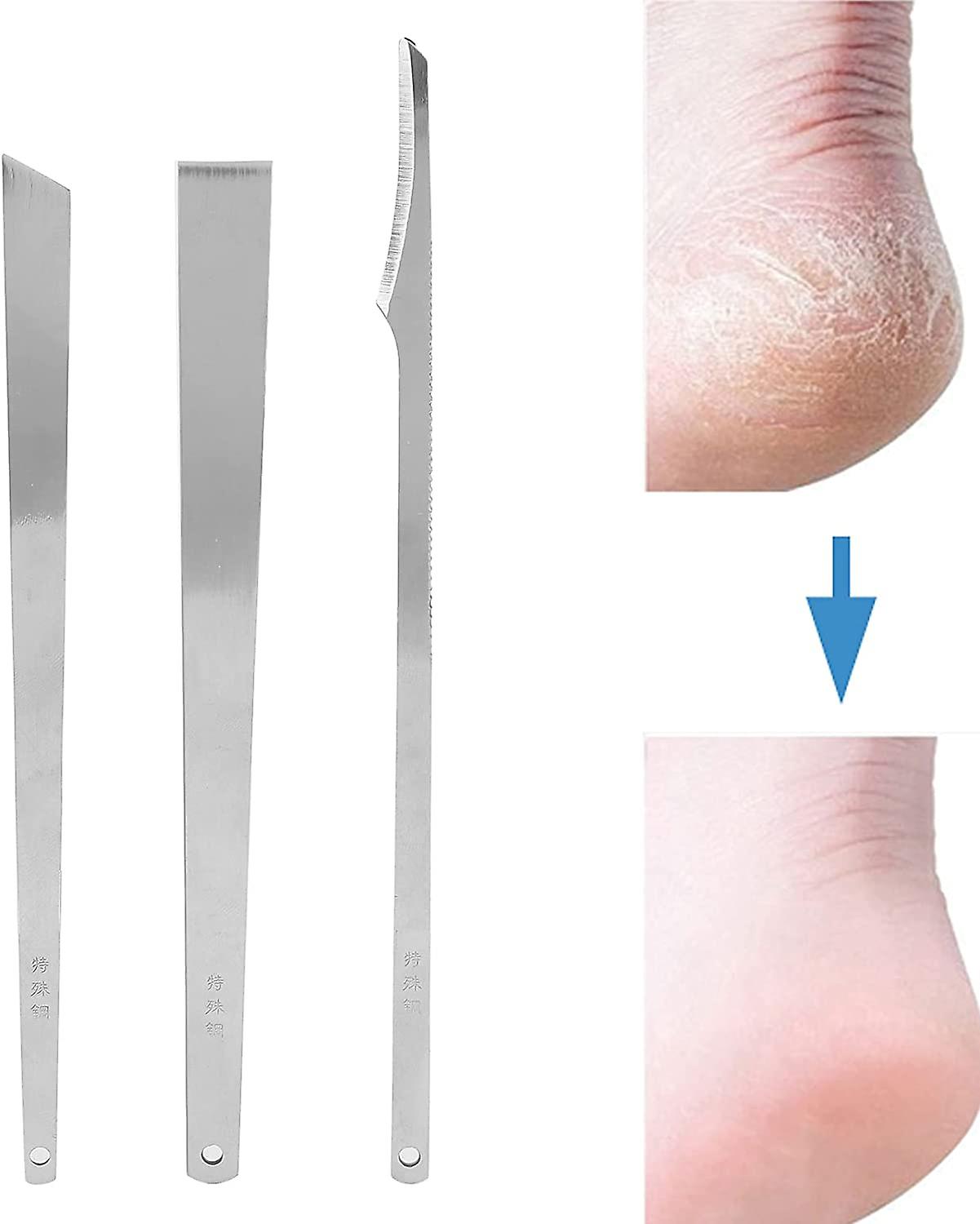 Pedicure Knife Set, 3 Pack Stainless Steel Ingrown Toenail Knife ...