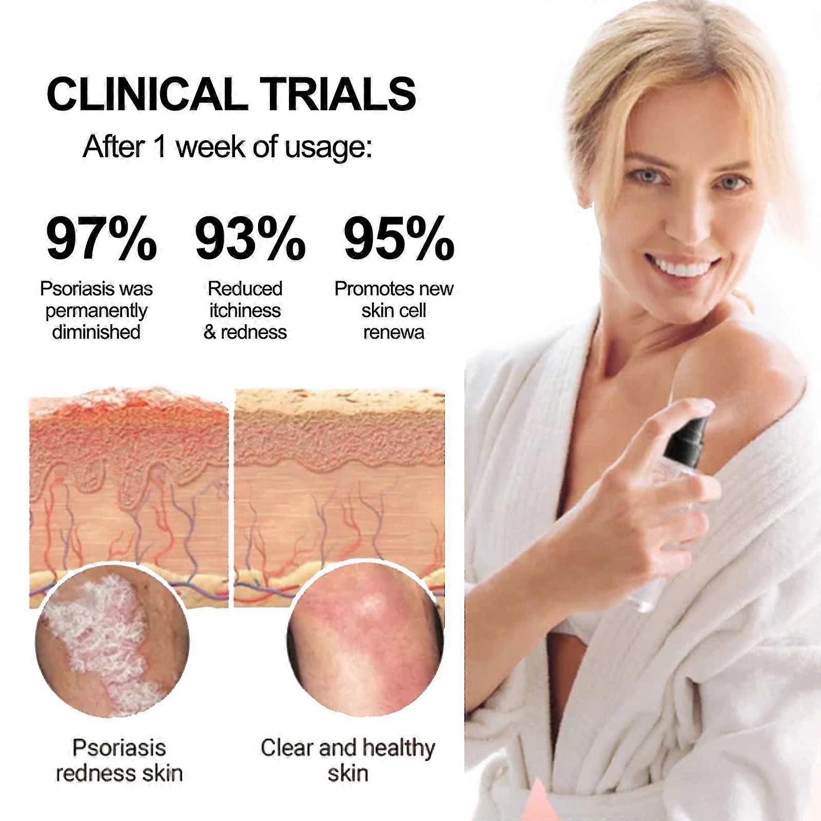 Psoriasis Treatment Spray Scalp Recovery Therapy, Scalp Psoriasis ...