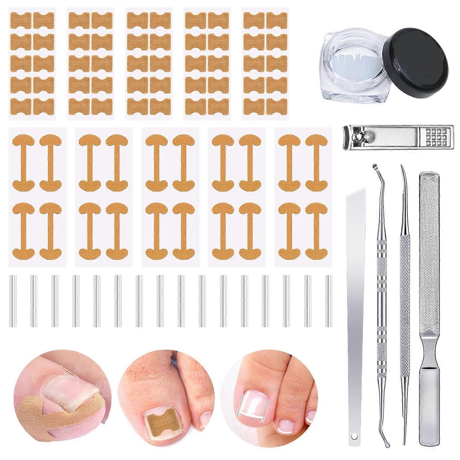 Professional Toenail Correction Kit with Toe Strips Curved Toenail ...