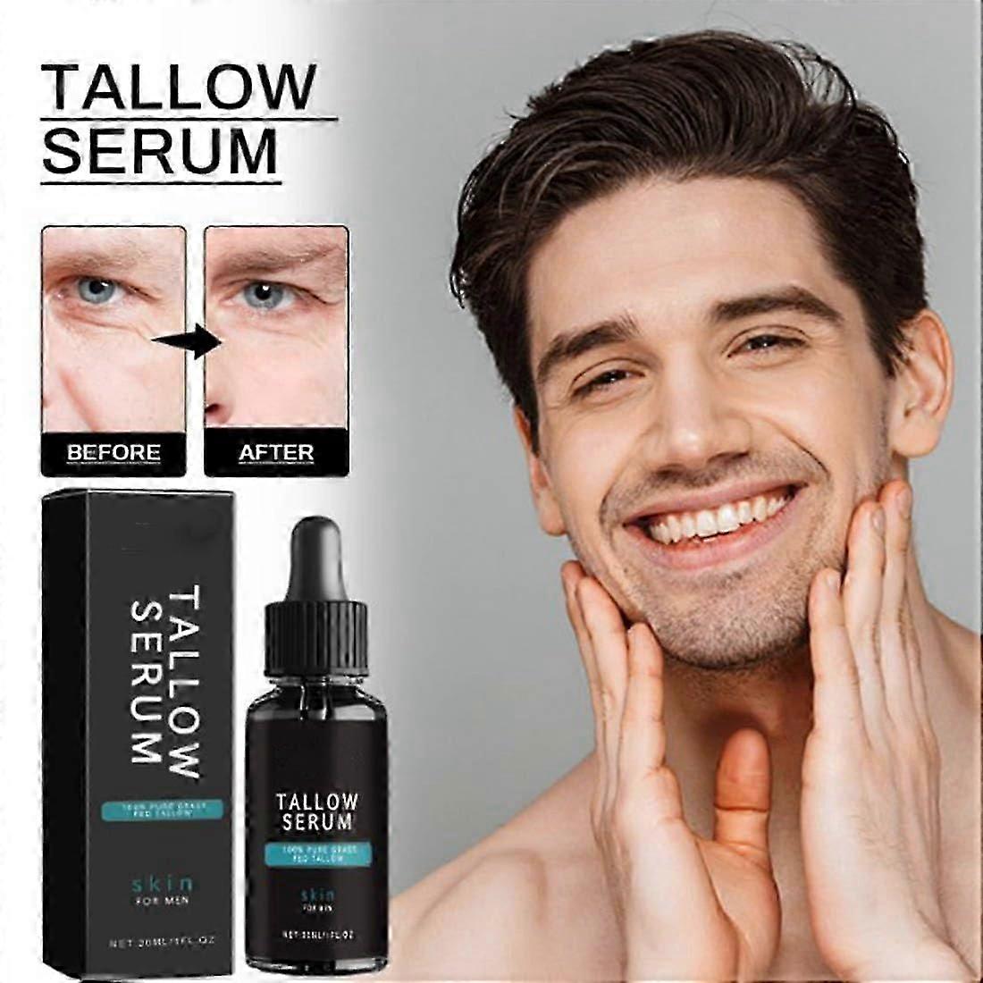 Wrinkle Defense Tallow Balm, Skin Care for Men, Natural Tallow Face ...