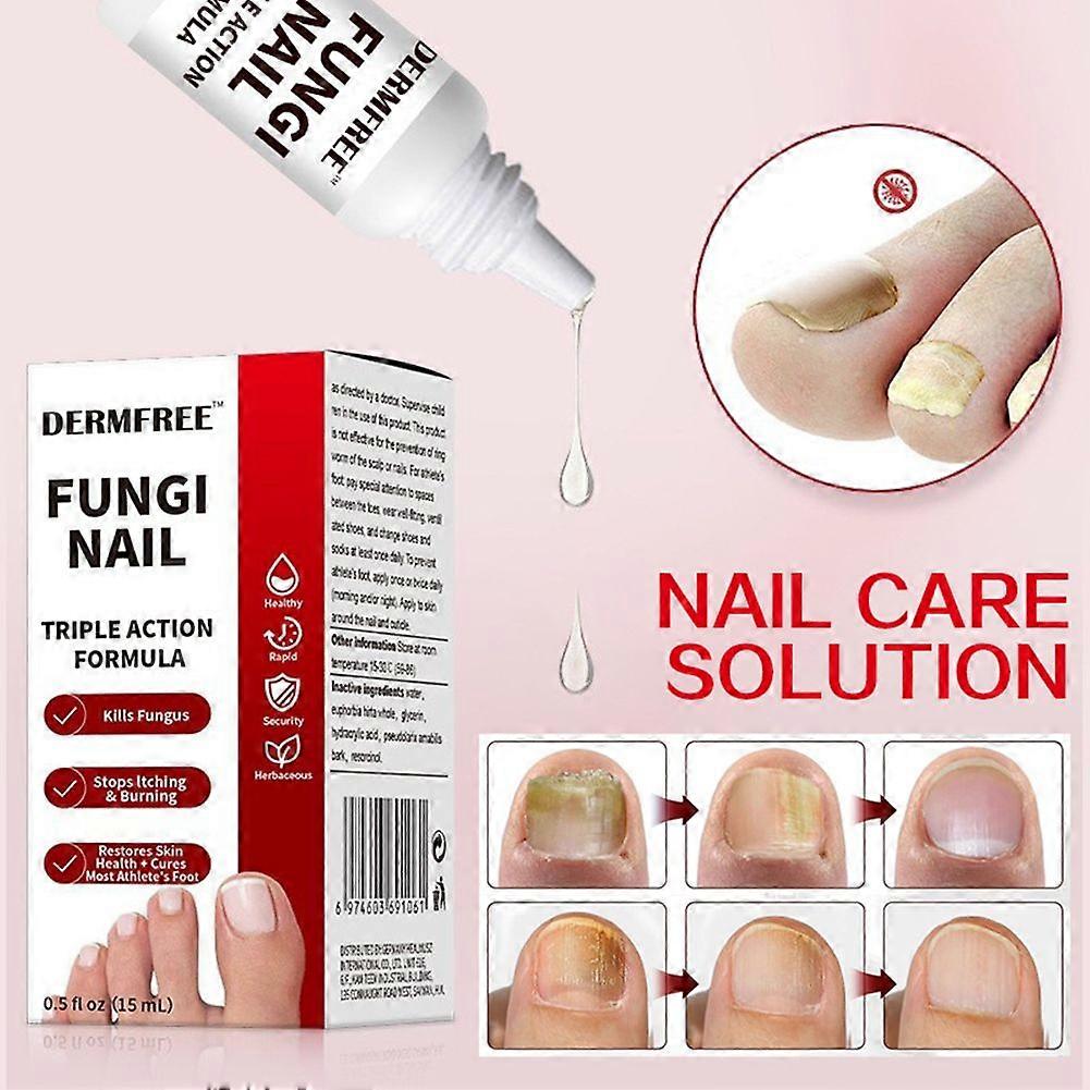 15ml Fungi Nail Treatment Liquid Fast-Acting Nail Repair Strengthening ...