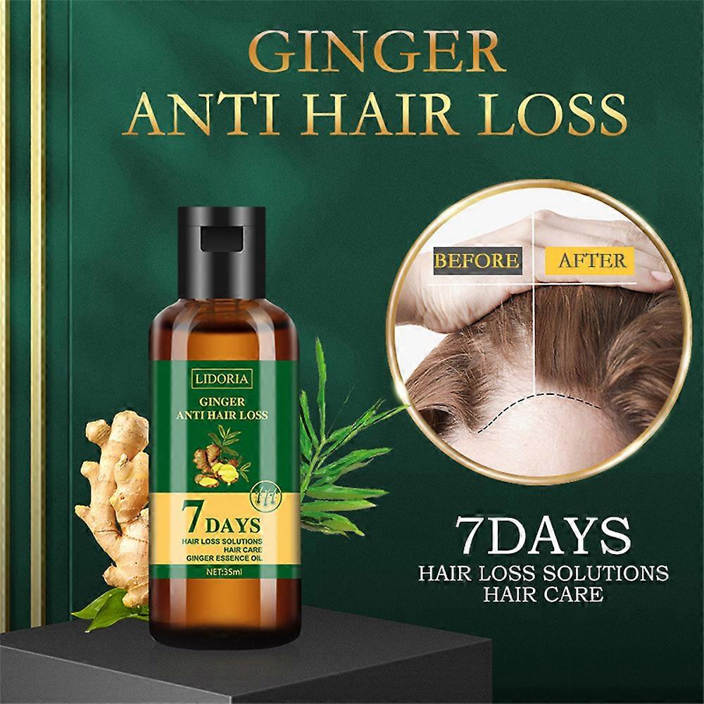 1-3X Lidoria Ginger Anti Hair Loss, Ginger Anti Hair Loss 7 Days Oil ...
