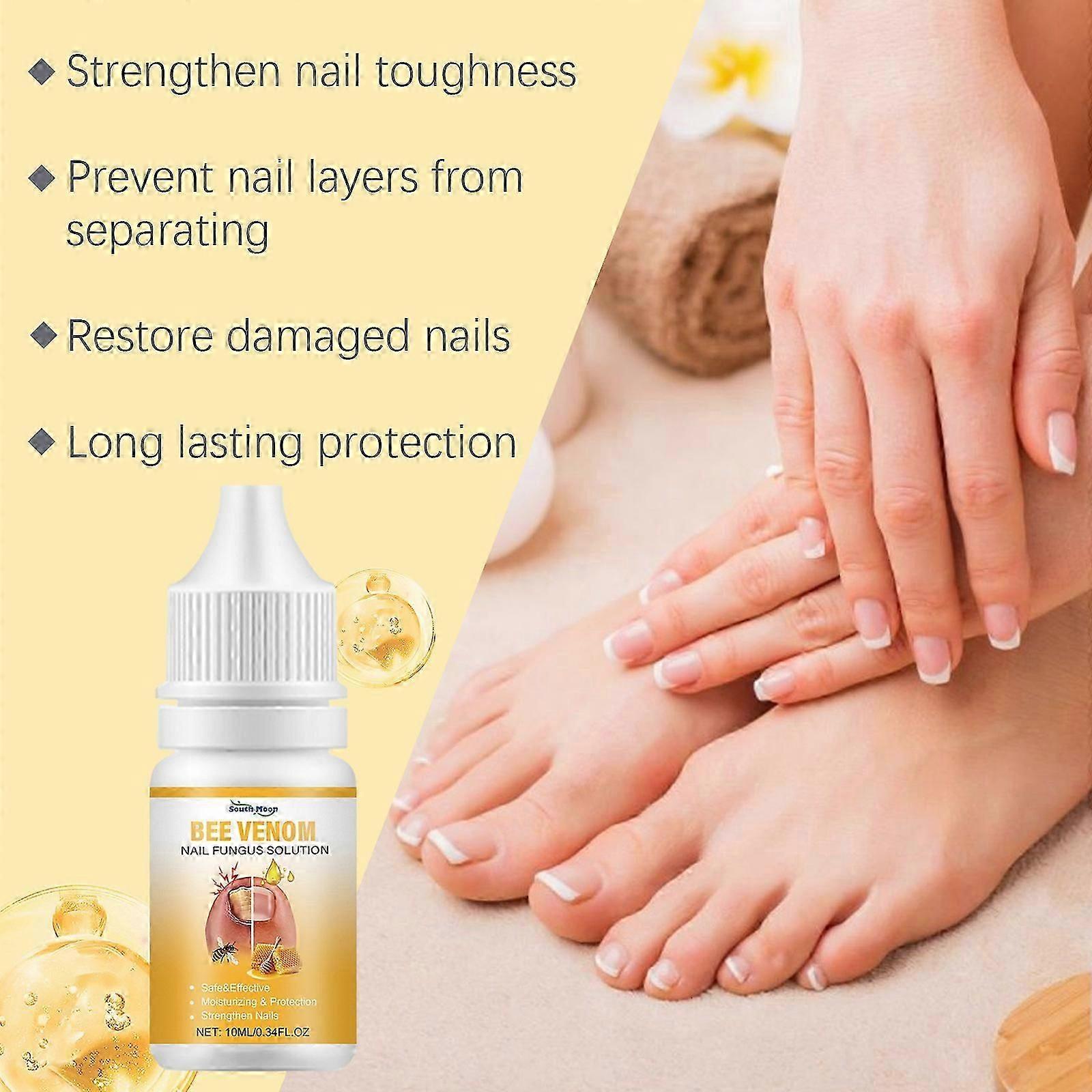 Bee Venom Fungal Nail Treatment for Toenail Extra Strong, Nail Fungus ...