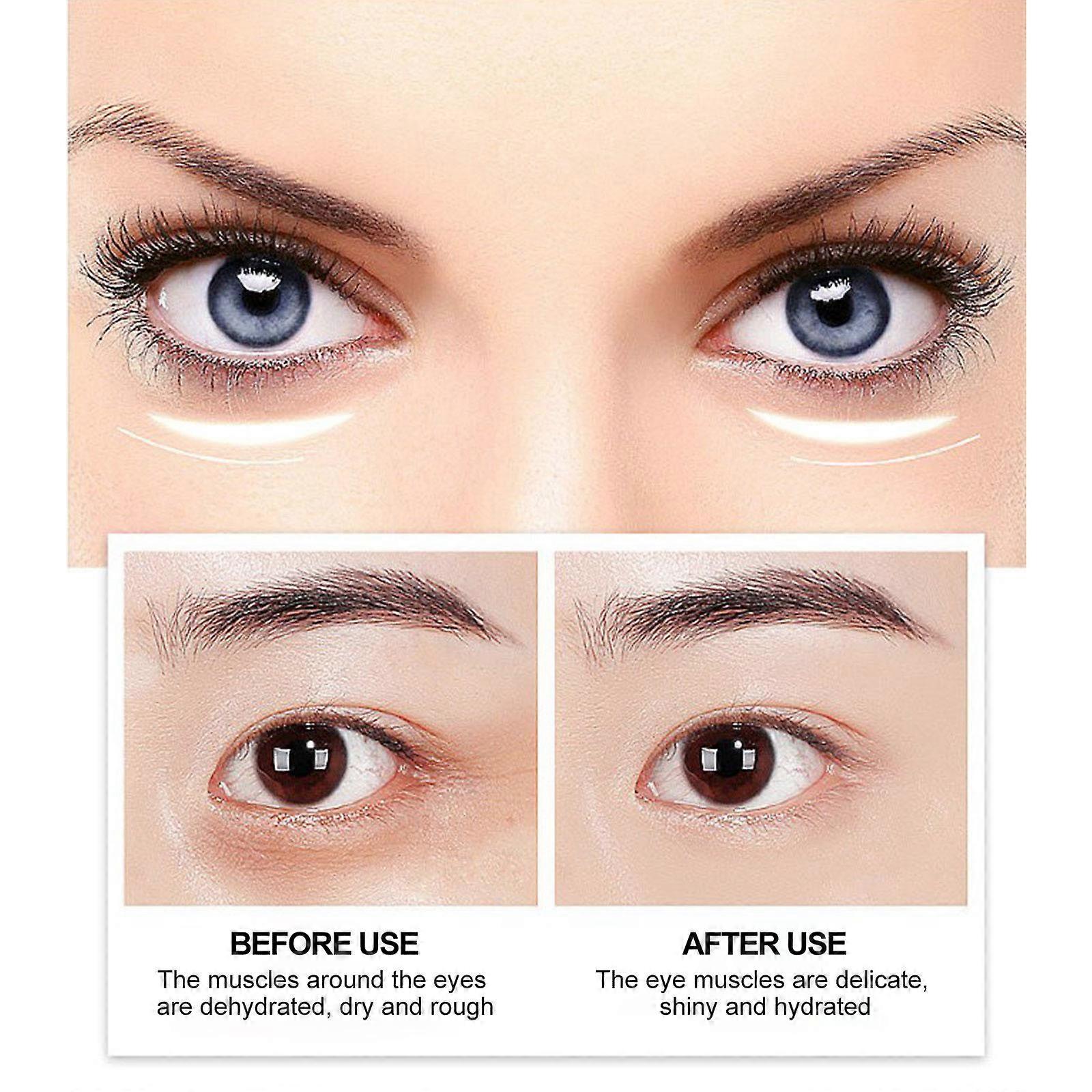 Eye Products Fade Dark Circles And Bags Under Eyes And Fine Lines Eye ...
