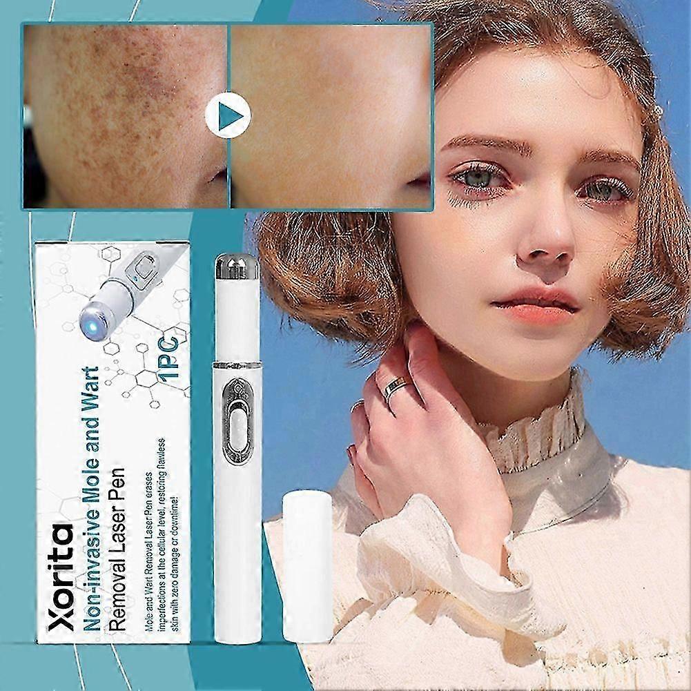 Non-invasive Blue Light Therapy Laser Pen Dark Spots Removal Painless ...