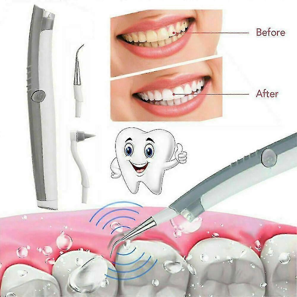Electric Sonic Dental Scaler Ultrasonic Tooth Stain Plaque Teeth Clean ...