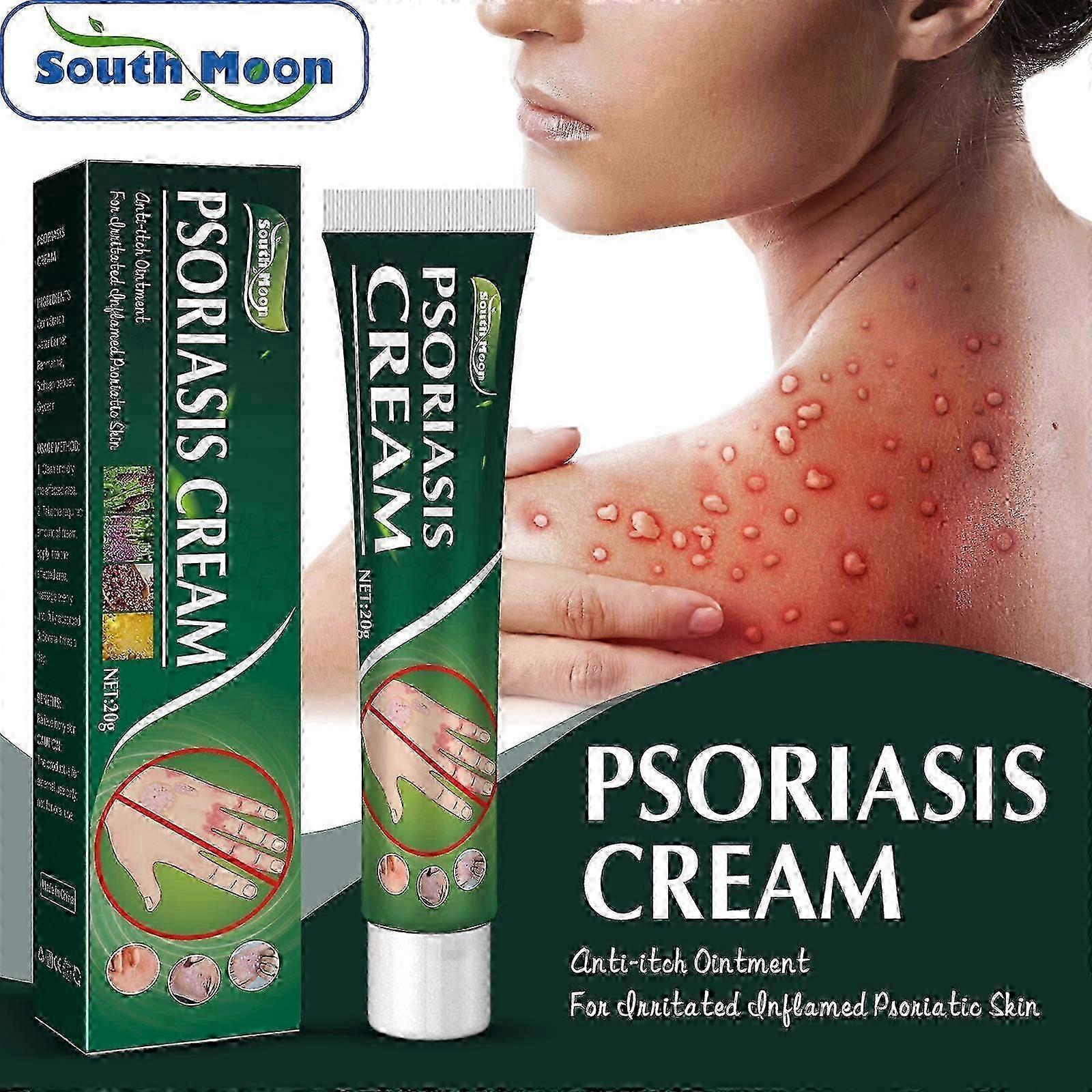 South Psoriasis Cream Repairs Psoriasis, Tinea Pedis And Tinea Pedis To ...