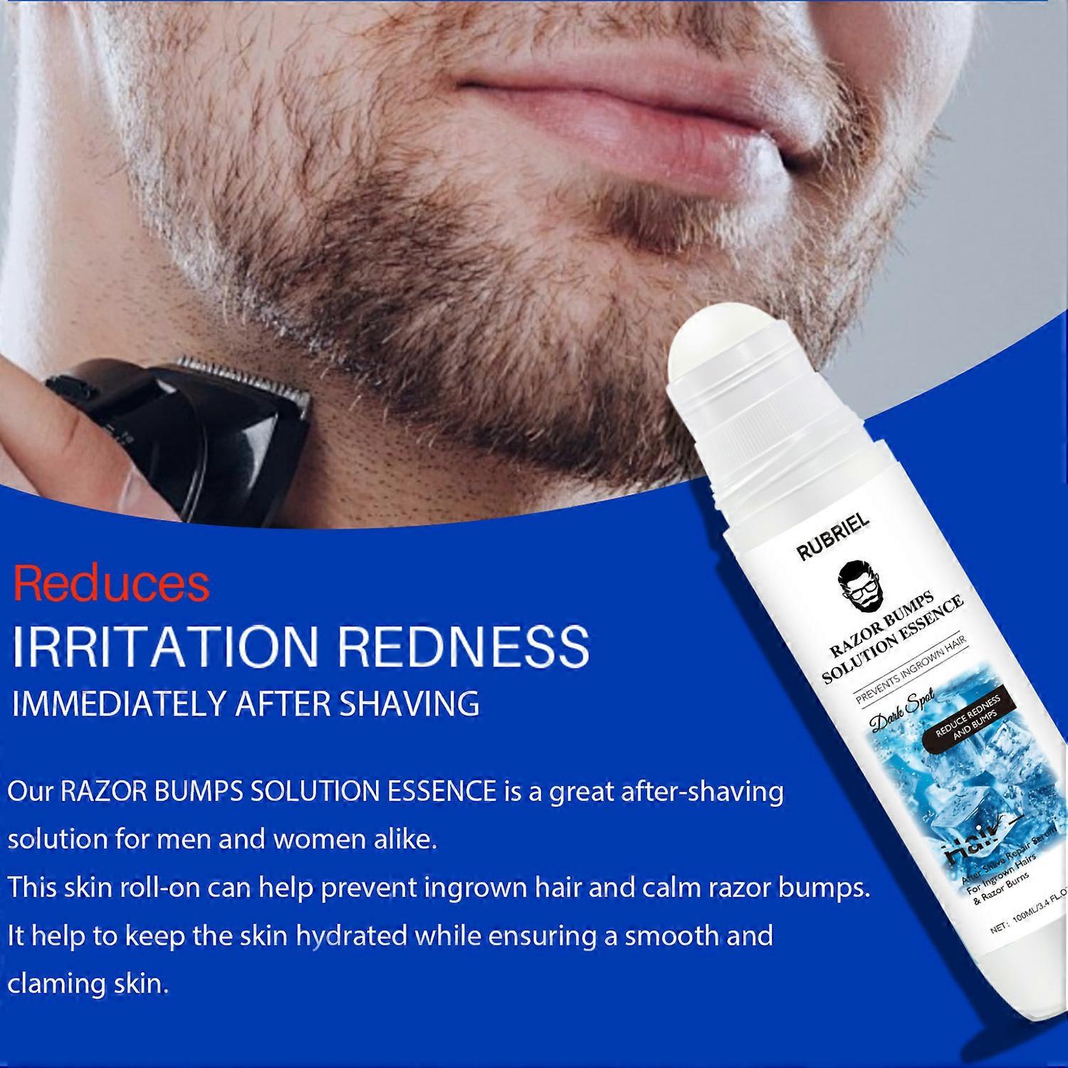 Razor Bumps Treatment For Men And Woman, Ingrown Hair Treatment After ...