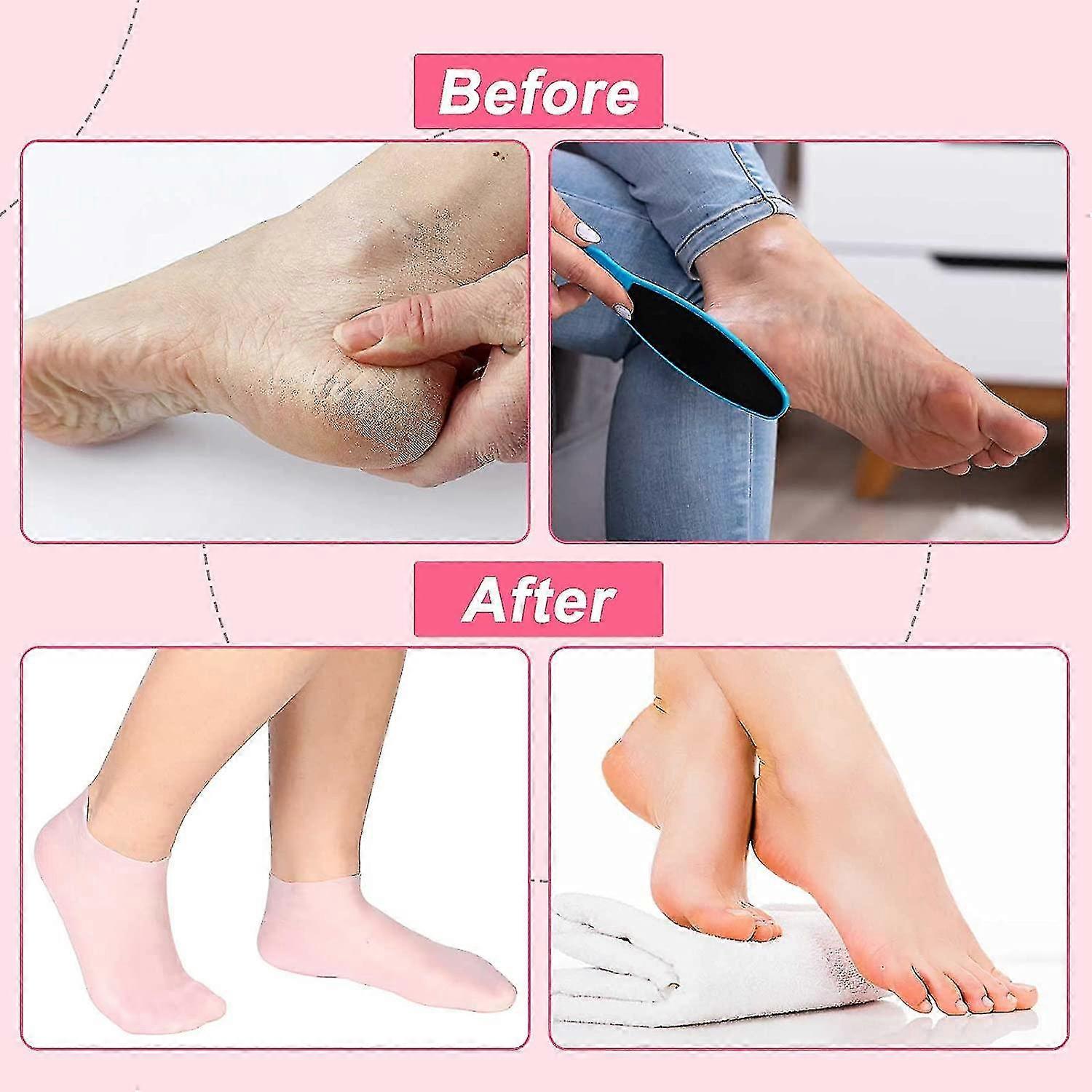 Silicone Socks 3 Pairs Aloe Socks Silicone Gel Heel Socks Anti Slip ...