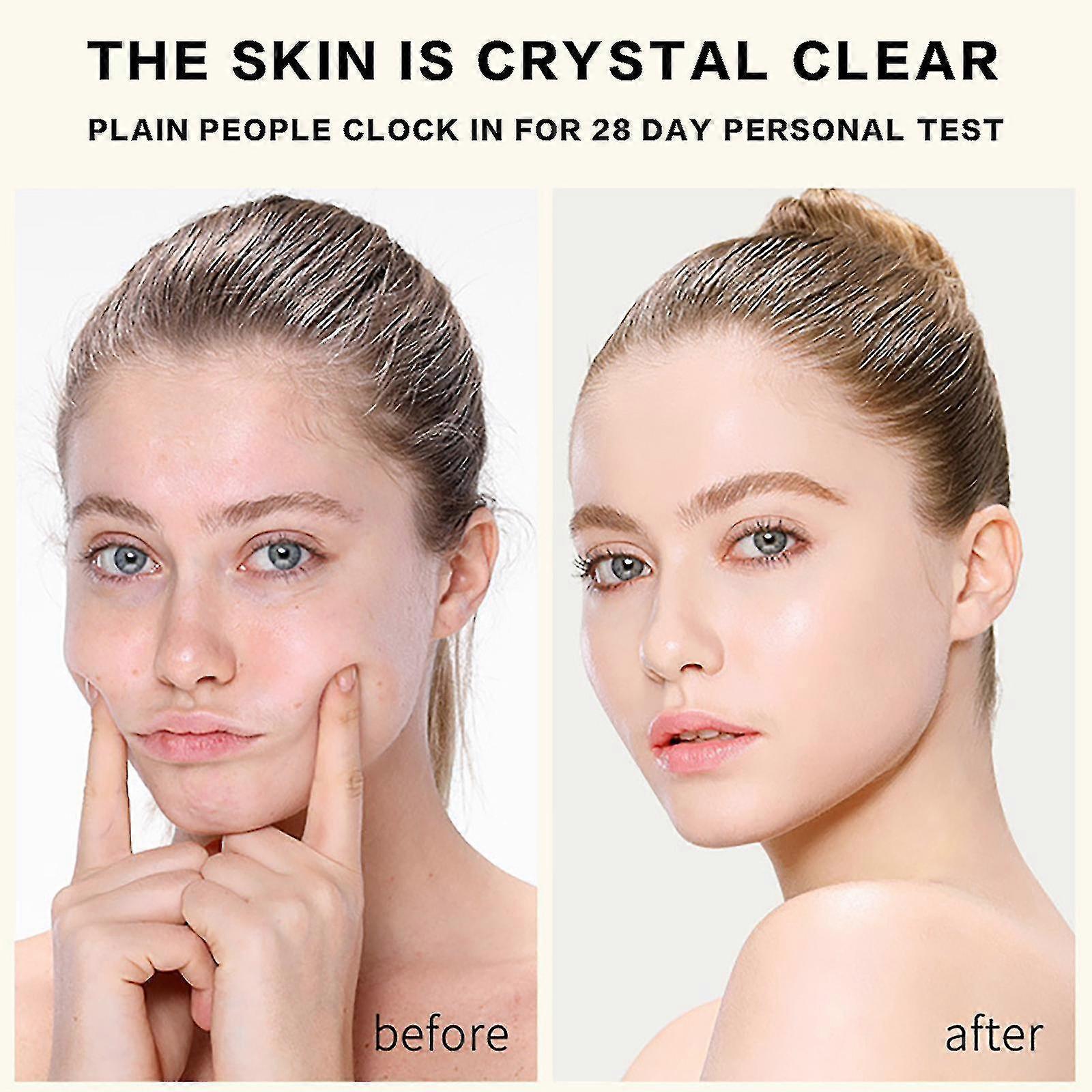 Soluble Protein Thread Combined With Nano Gold Essence Gold Protein ...