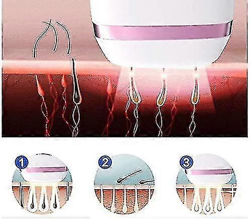 Ipl Laser Hair Removal Instrument, 500,000 Flashes, 5 Levels Of Light ...