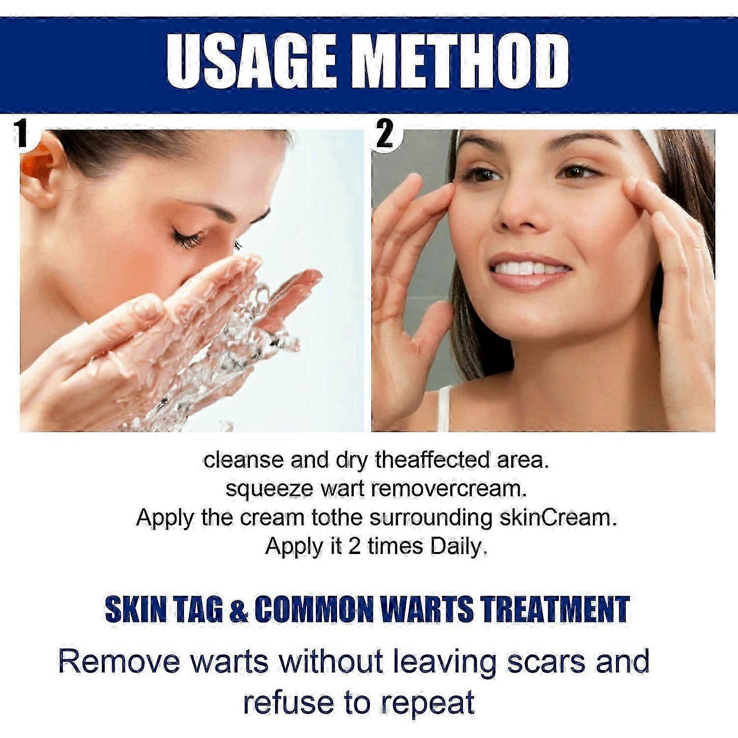 1-3Pcs Wart Remover Genital Ointment Herpe Cream Acuminatum ...