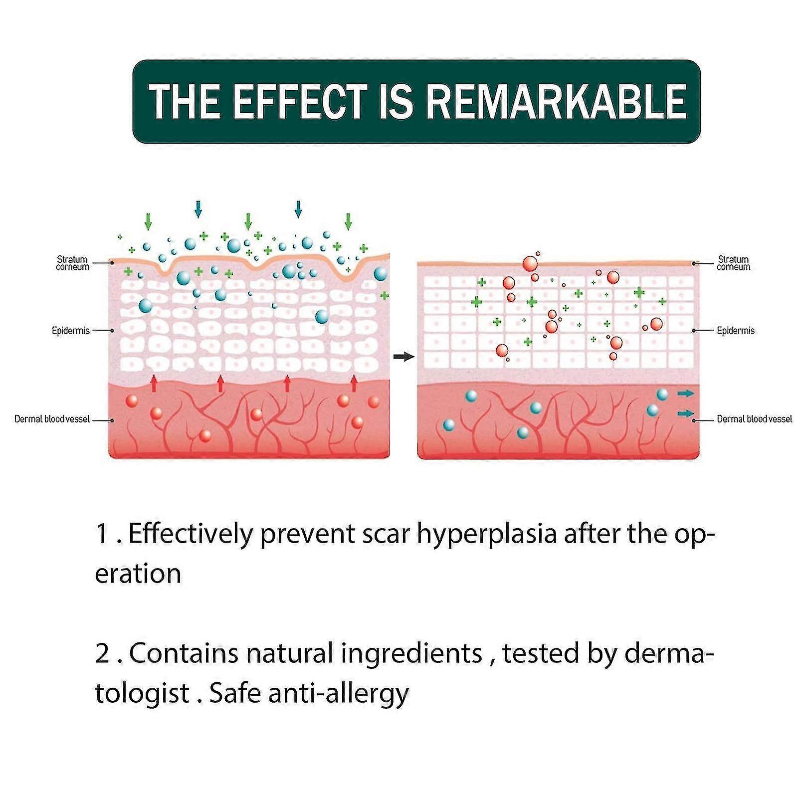 Silicone Scar Sheets - Extra Long Scar Sheets for C-Section, Tummy Tuck ...