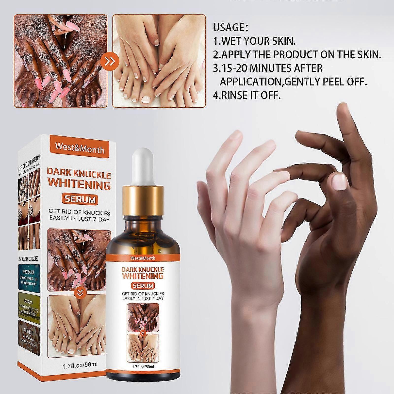 GFOUK Acanthosis Nigricans Therapy Oil, Dark Knuckles Serum 50ml - 1/3 ...