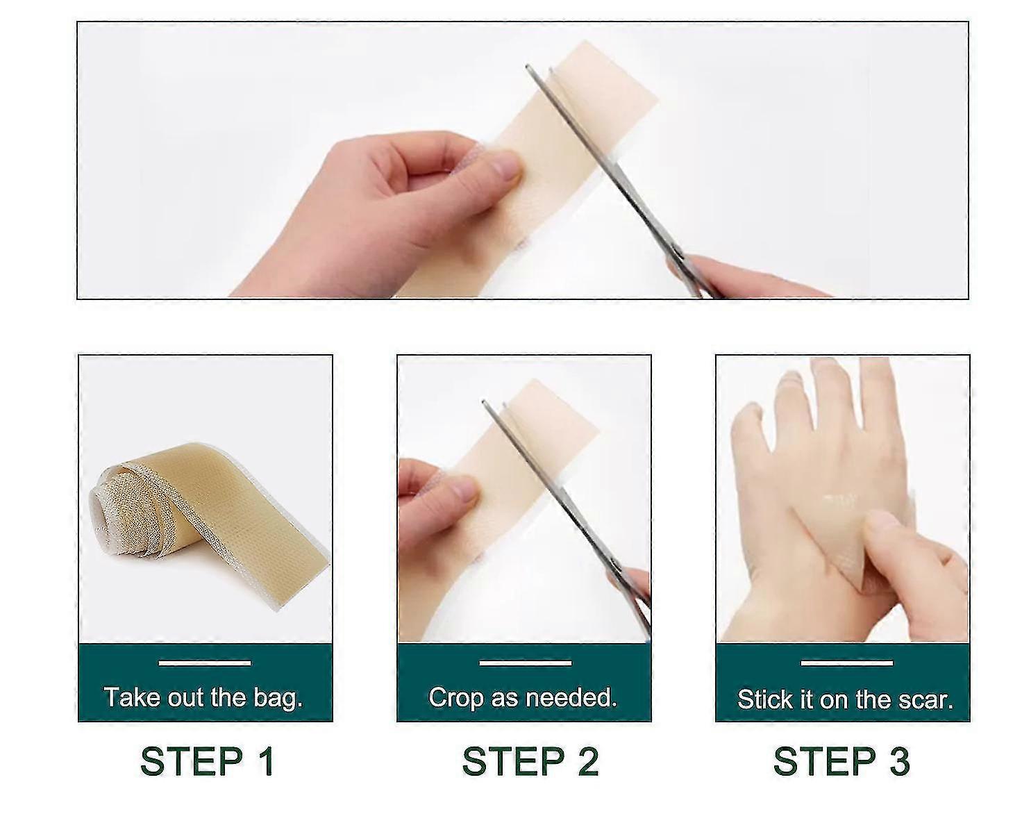 Scar Stickers Self-adhesive Scar Stickers Wound Stickers Cesarean ...