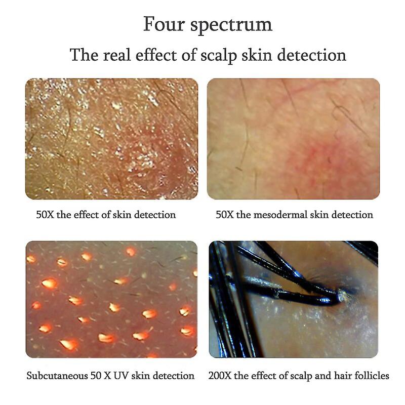 Professional Skin Hair Detector Scalp Hair Follicle Moisture Skin Pores ...