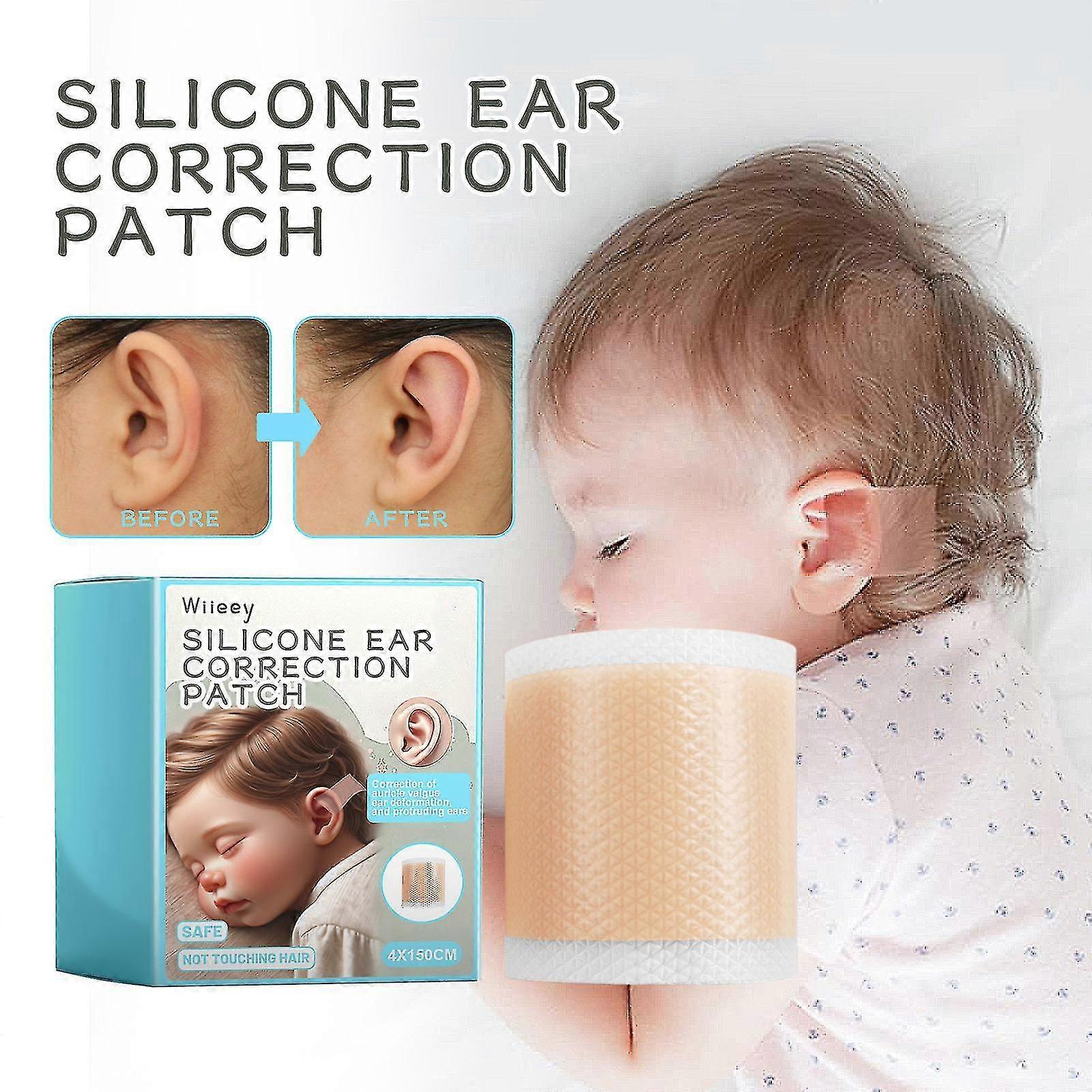 Silicone Ear Correctors Tape, Baby Auricle Valgus Correction Patch ...