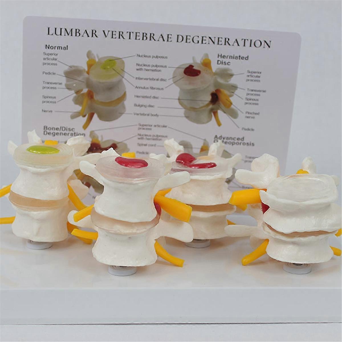 Four Stage Vertebrae Model, Human Anatomy and Physiology Educational ...