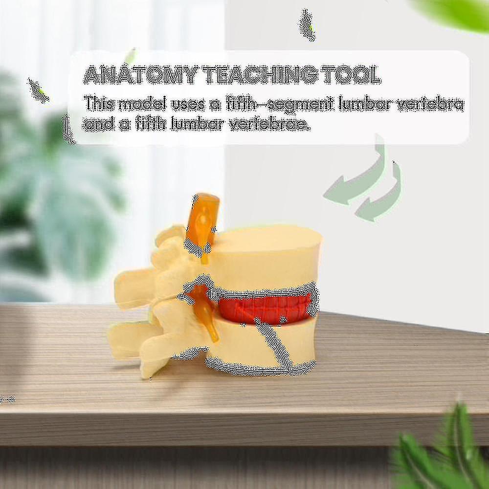 Lumbar Vertebrae Model Lumbar Disc Herniation Anatomy Teaching Tool ...