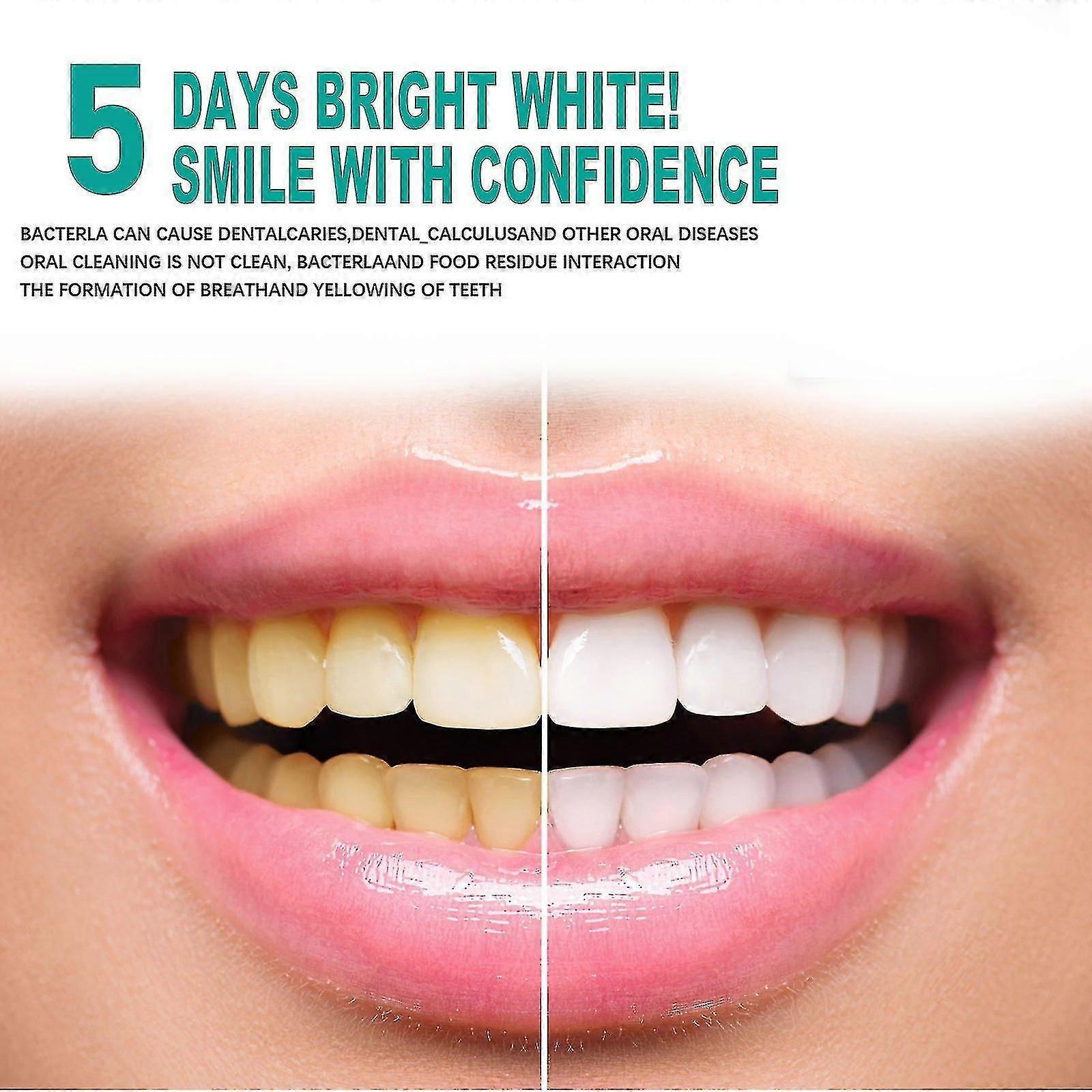5-day Beauty Tooth Powder Whitening And Cleaning Teeth Smoke Stains To ...