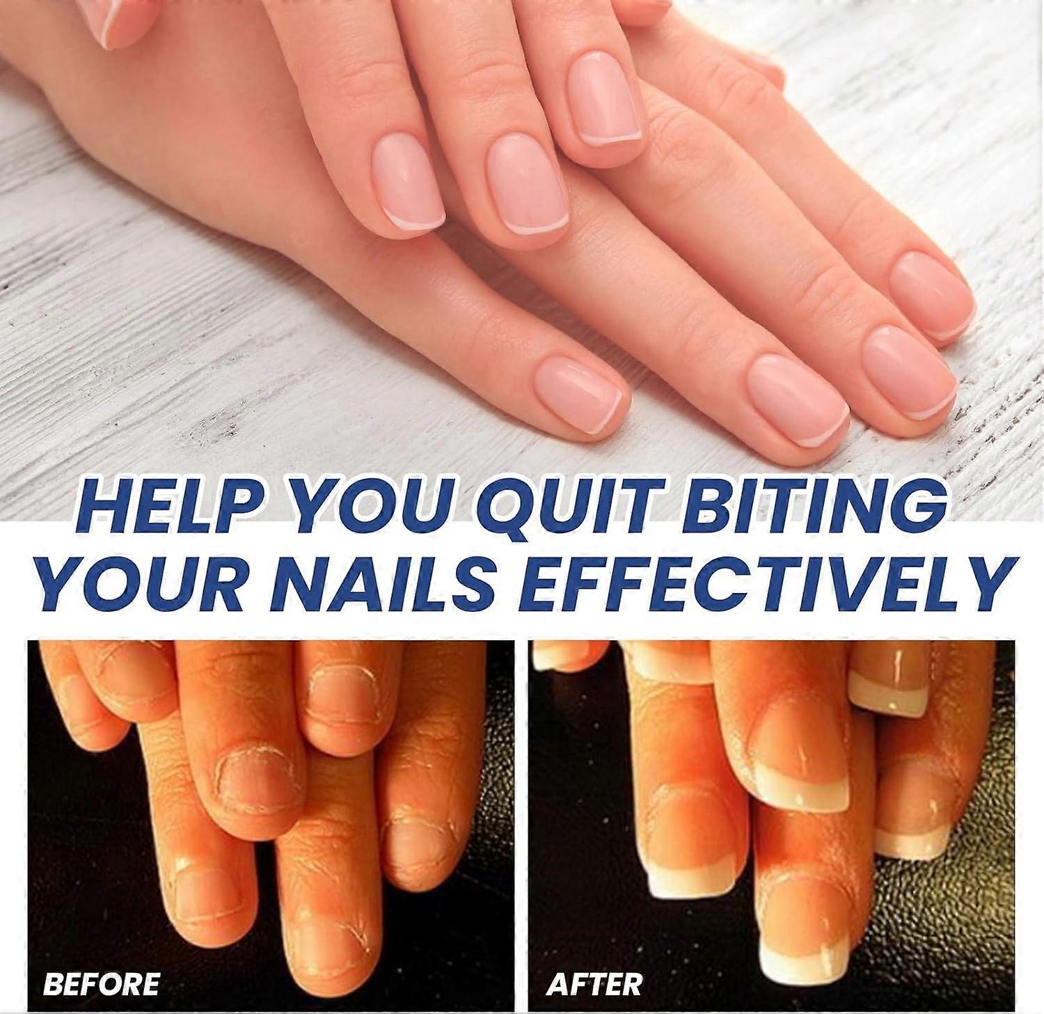 Anti Nail Biting Nail Polish,Stop and Grow Nail Biting,Stop Nail Biting ...