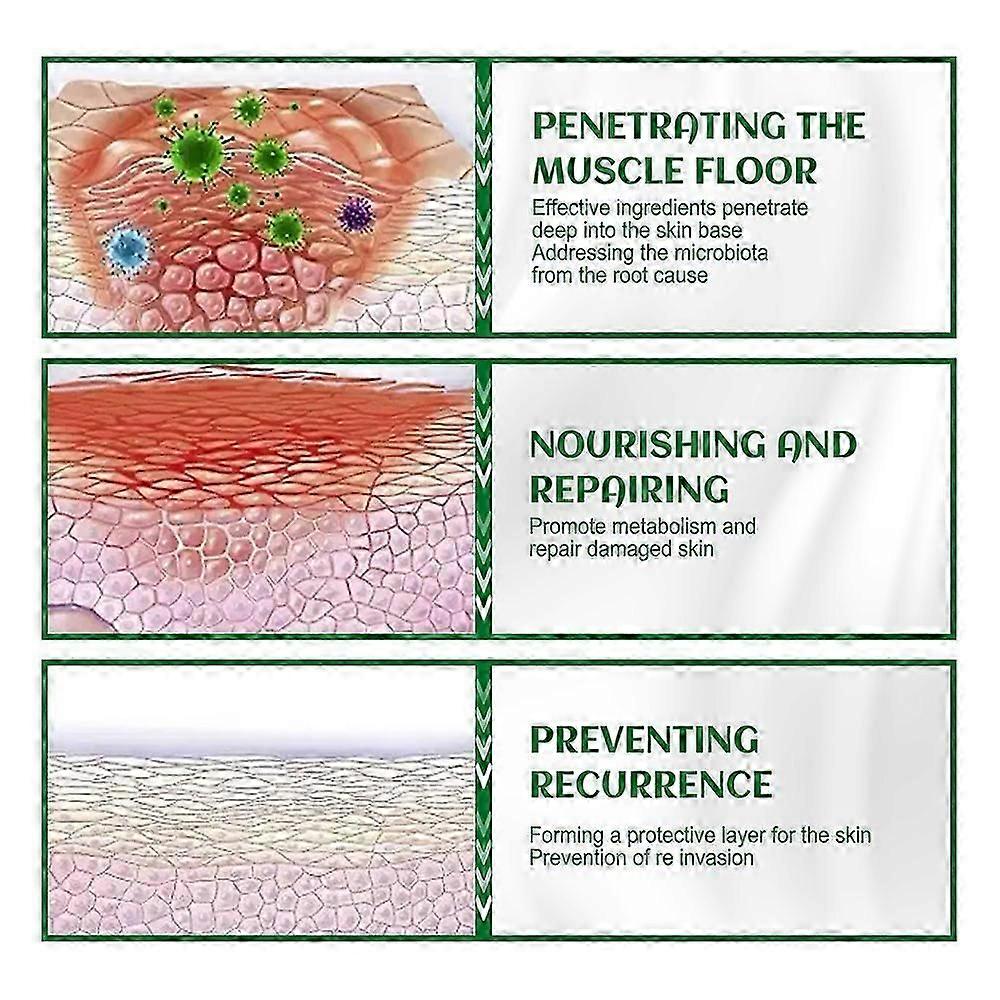 Hair Follicle Cream Treat Scalp Hair Folliculitis Skin Inflammation ...