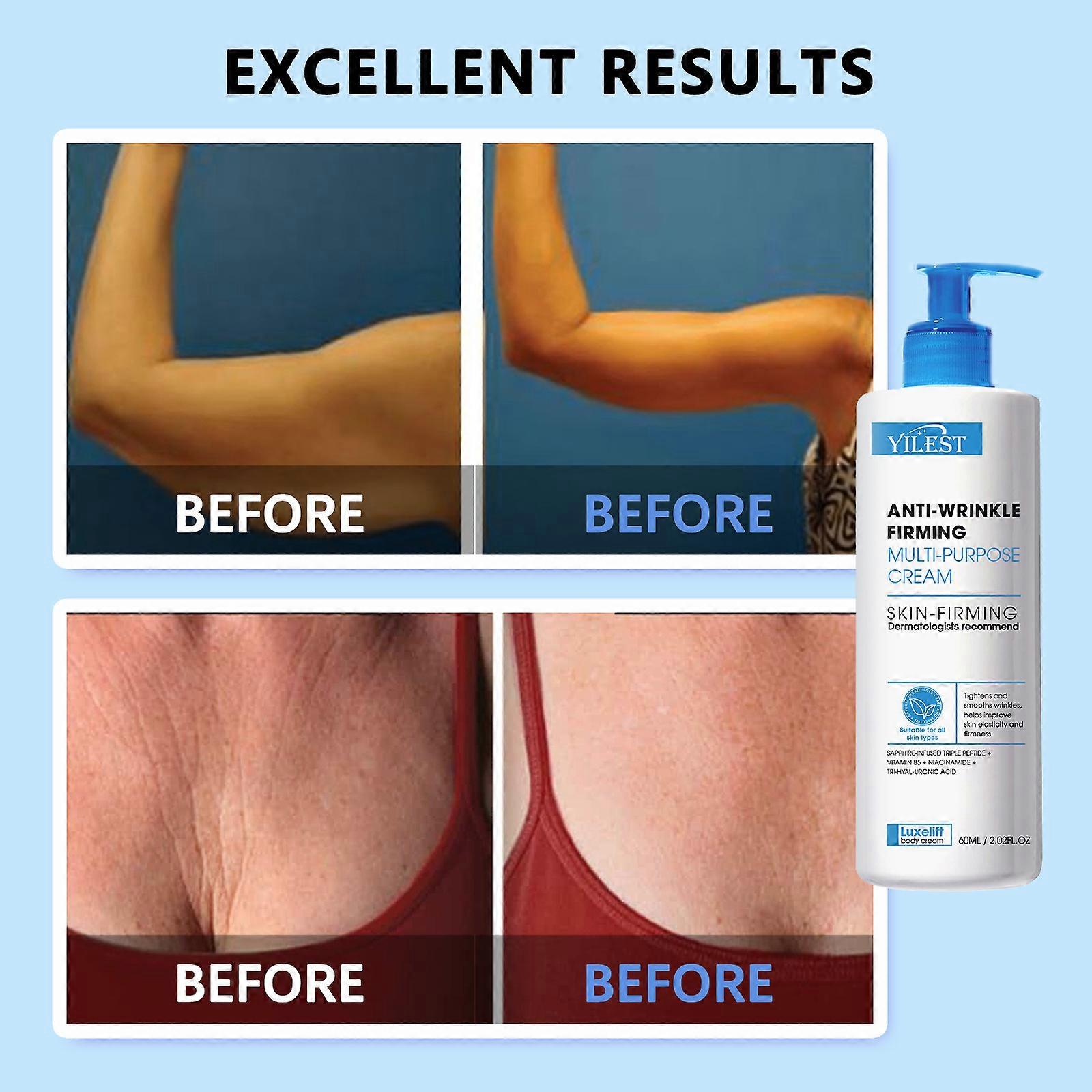 Advanced Skin Tightening Rejuvenating Cream, Anti-Aging Moisturizer ...