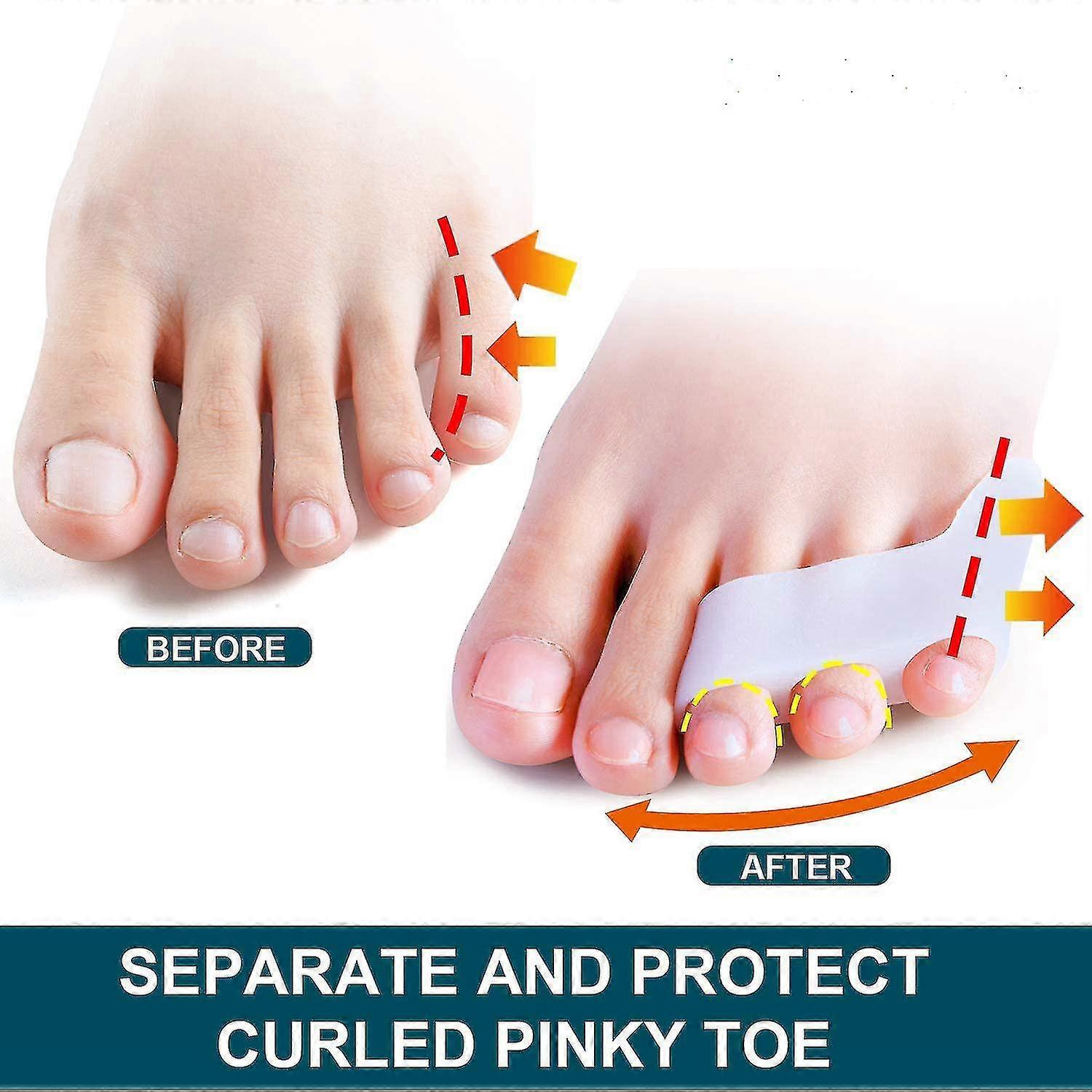 10 Pa Pinky Toe Separator And Protectors, Triple Gel Toe Separators For ...