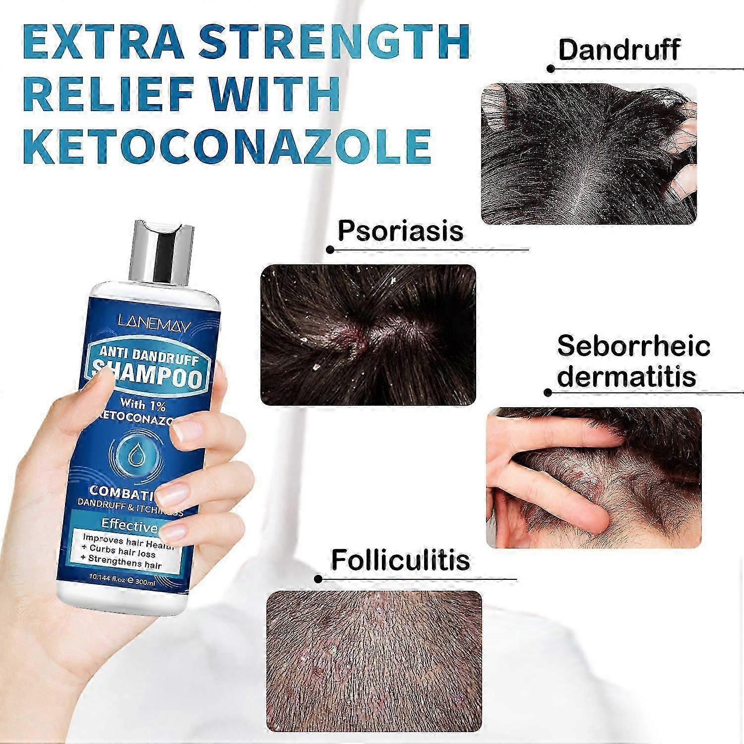 Anti-Dandruff Shampoo + Seborrheic Dermatitis Cream Set, Anti Fungal ...