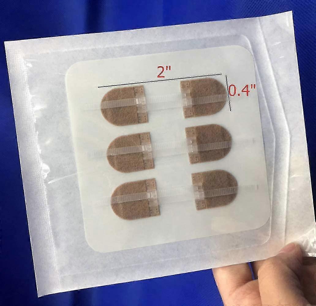 Emergency Wound Closures Band-aid Adhesive Bandages, Zip Stitch ...