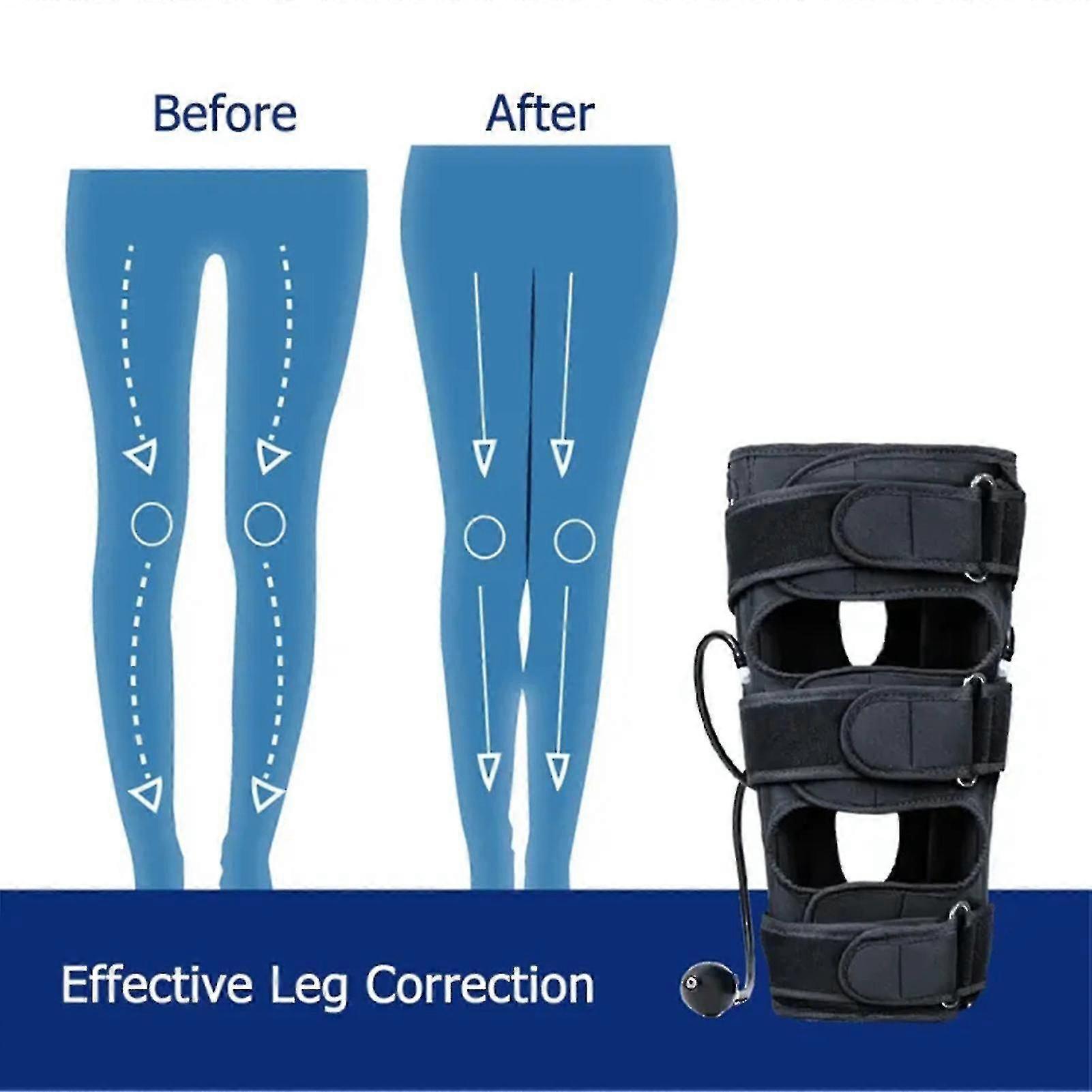 Arched Leg Orthosis, Lightweight O/x Leg Bandage, Dual Fixation ...