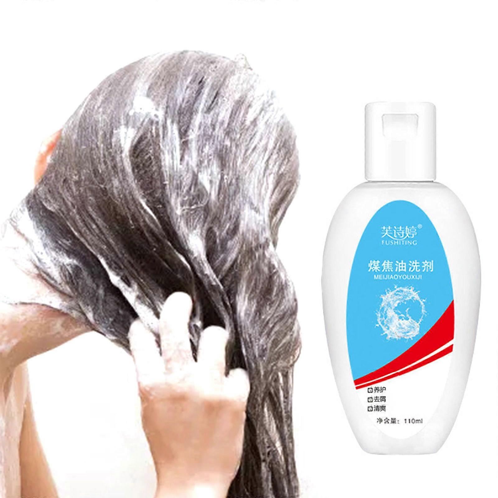 Coal Tar Anti-Dandruff Itching and Flaking Scalp Psoriasis Shampoo ...