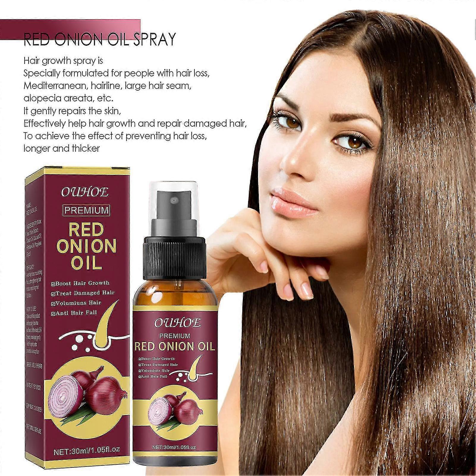 Onion Hair Growth Spray With Healthy Herbal Formula Spray For Stronger ...